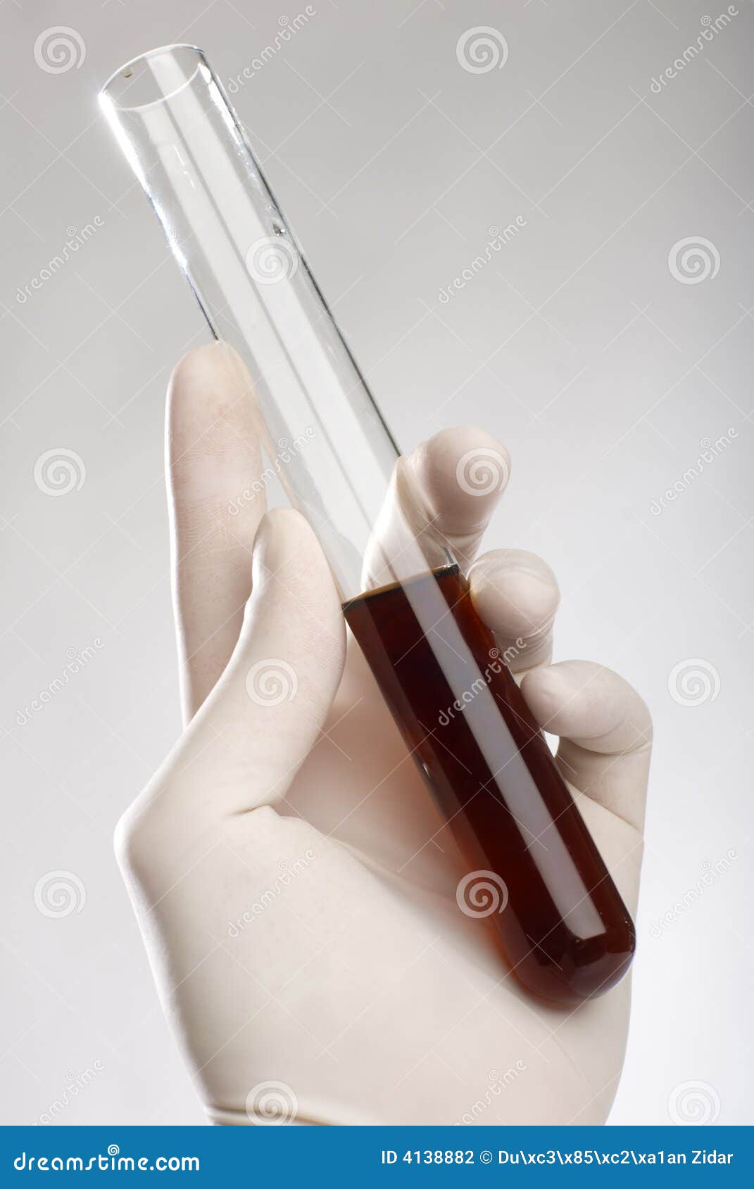 Blod arkivfoto. Bild av läkarundersökning, vätska, hand - 4138882