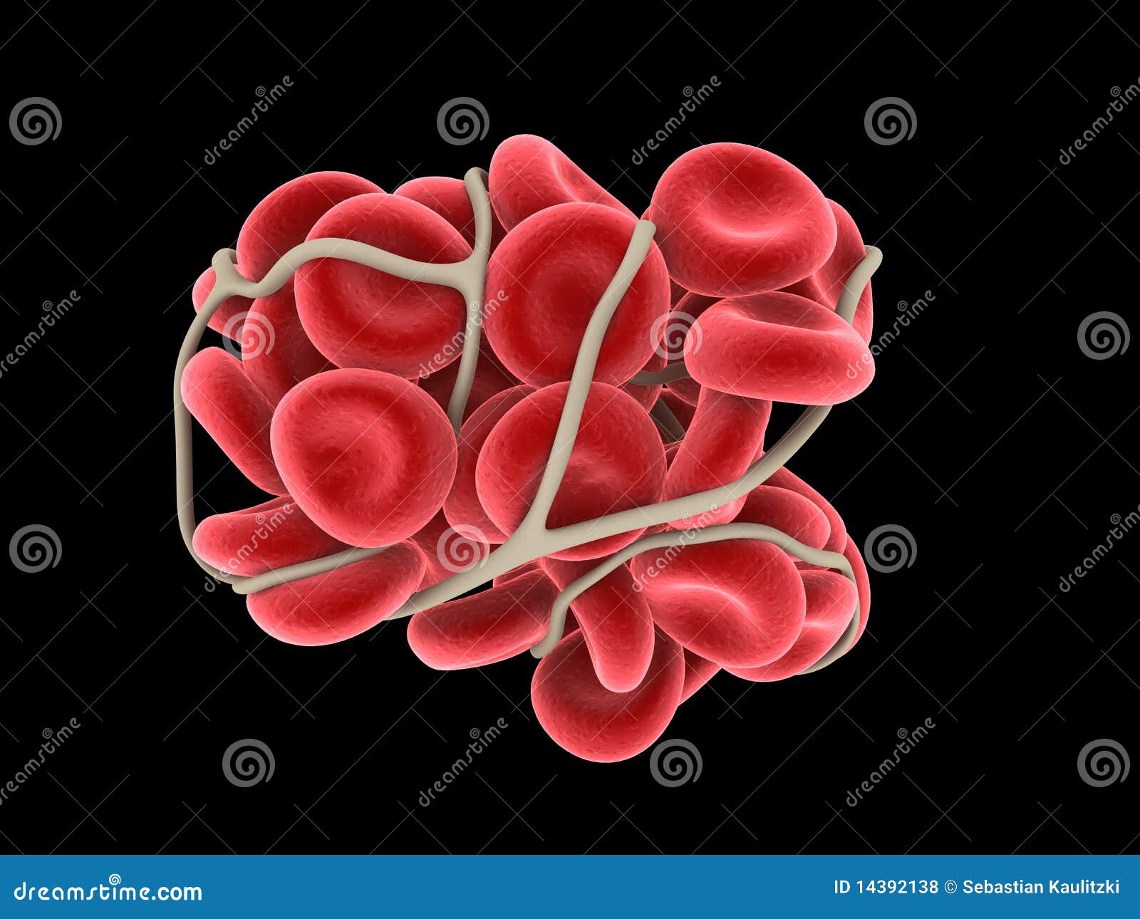 Blodpropp stock illustrationer. Illustration av akut - 14392138