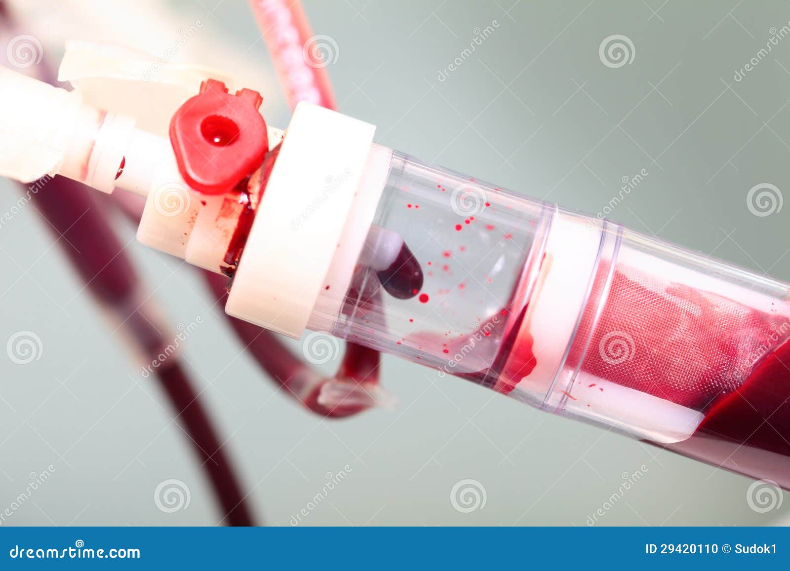 Blodtransfusion. arkivfoto. Bild av baggies, hälsa, hjälpmedel - 29420110
