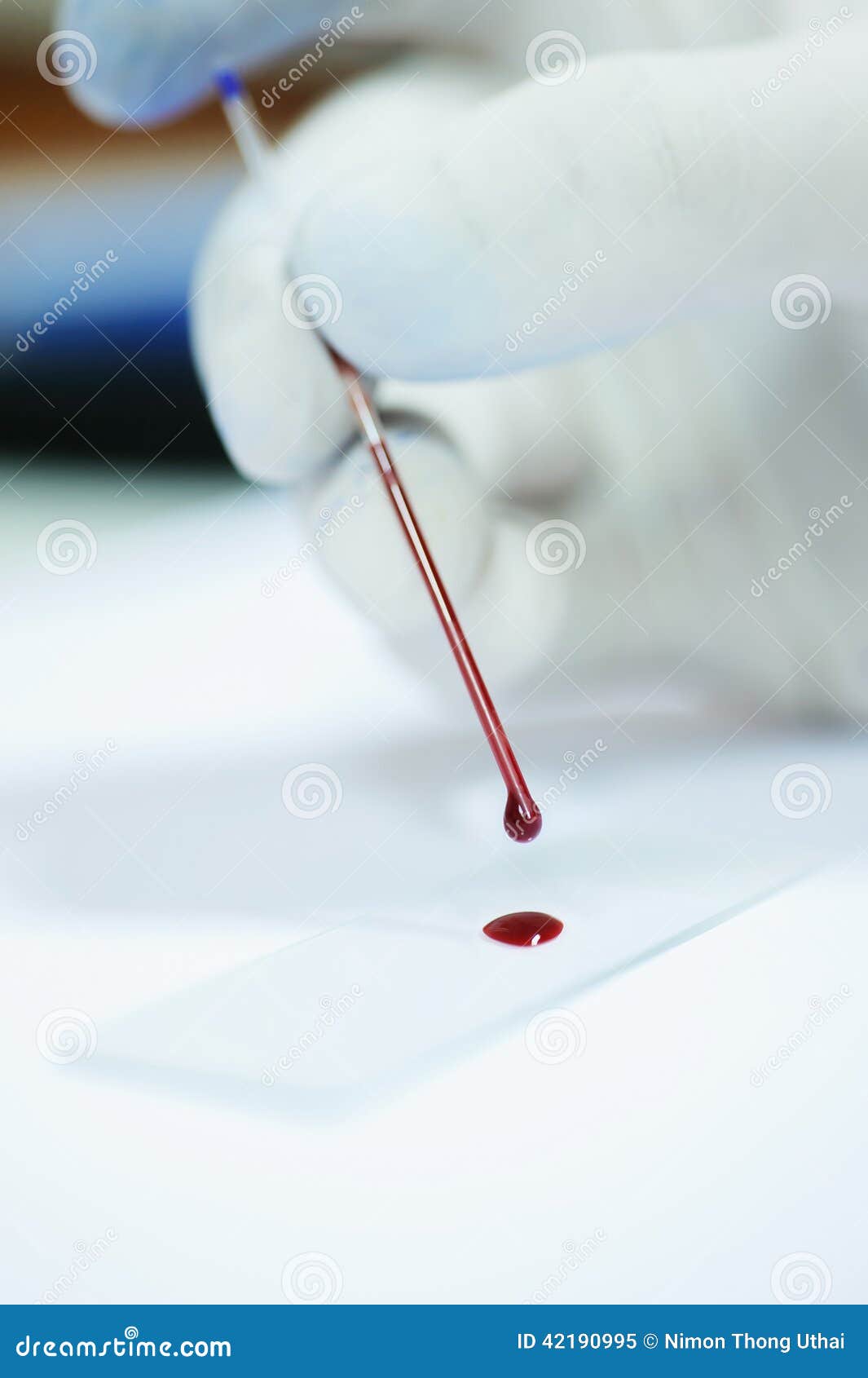 Bloed Het Testen in Laboratorium Stock Afbeelding - Image of arts ...