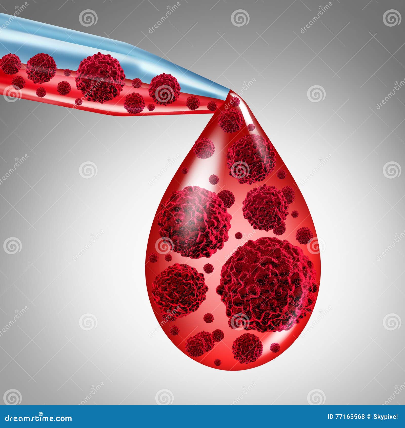 Bloedkanker stock illustratie. Illustration of leukemie - 77163568