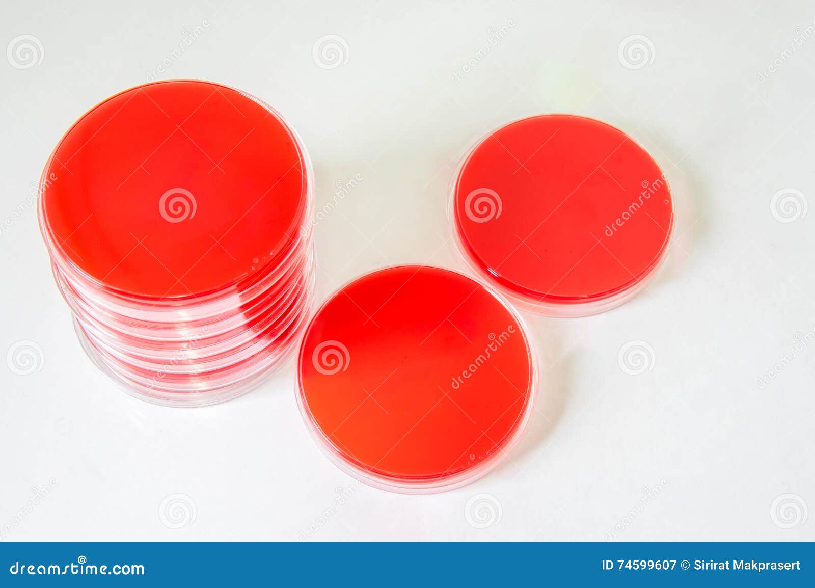 Blood Agar Culture Plate With Salmonella Colonies Stock Photography ...