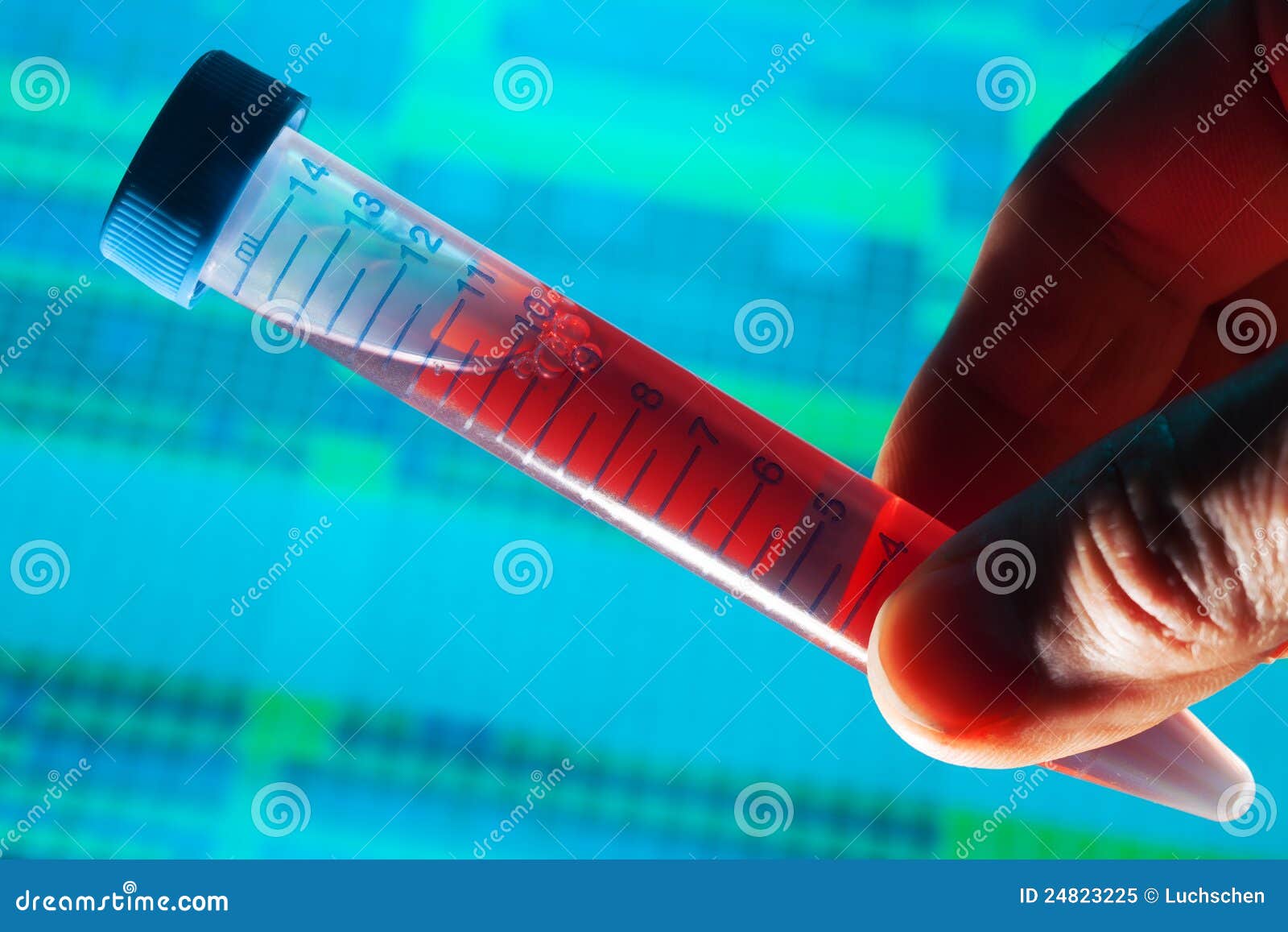 Blood analysis stock image. Image of medicine, research - 24823225