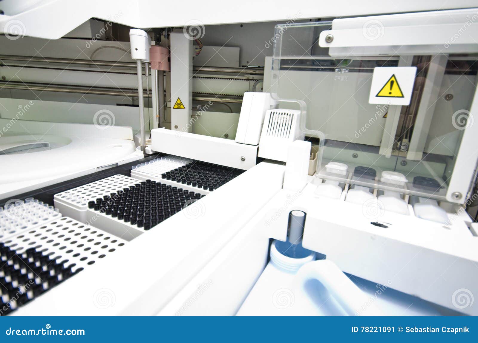 Blood analysis laboratory stock image. Image of medic - 78221091