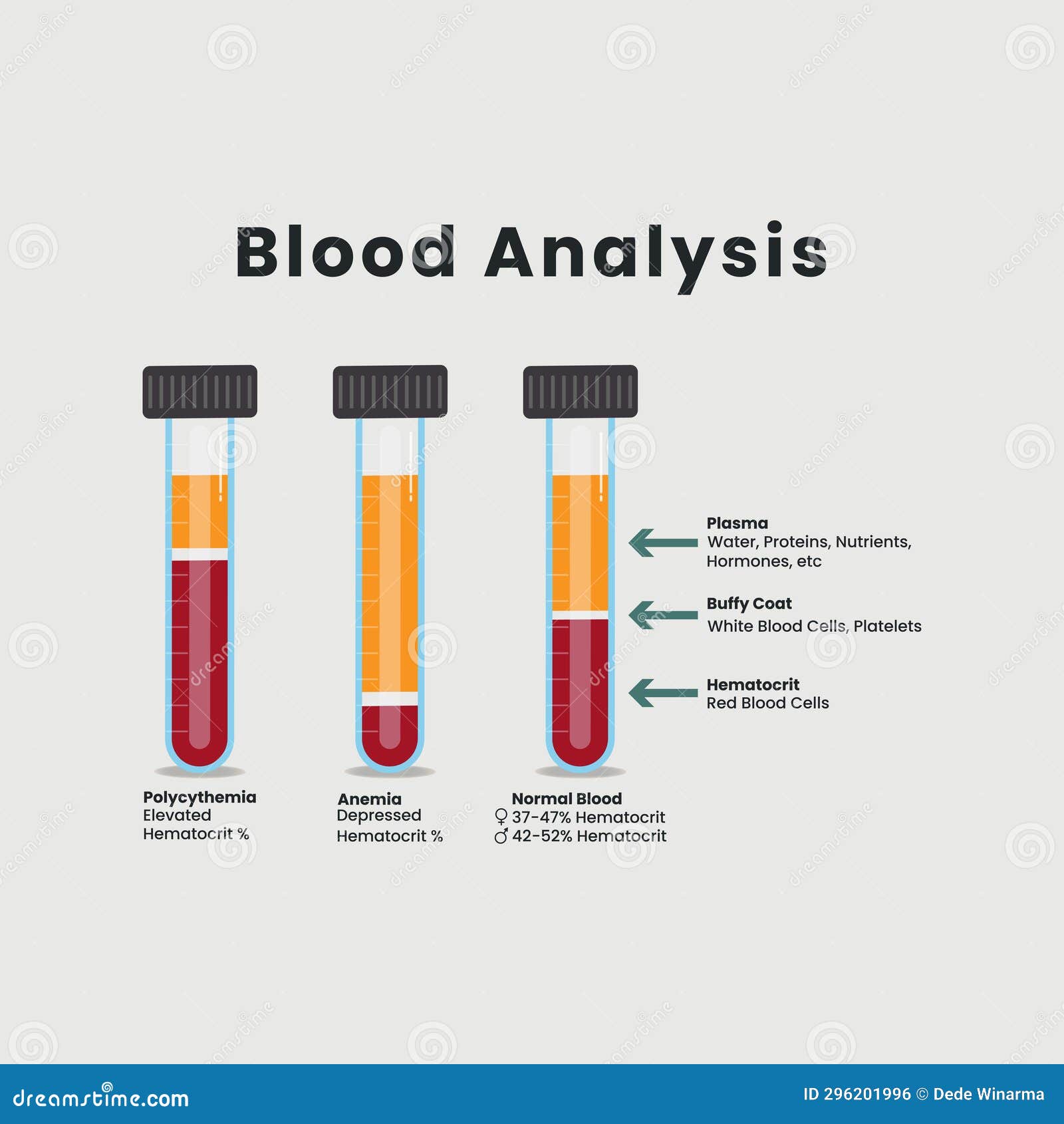 Blood Analysis in Test Tubes Design Vector Stock Vector - Illustration ...