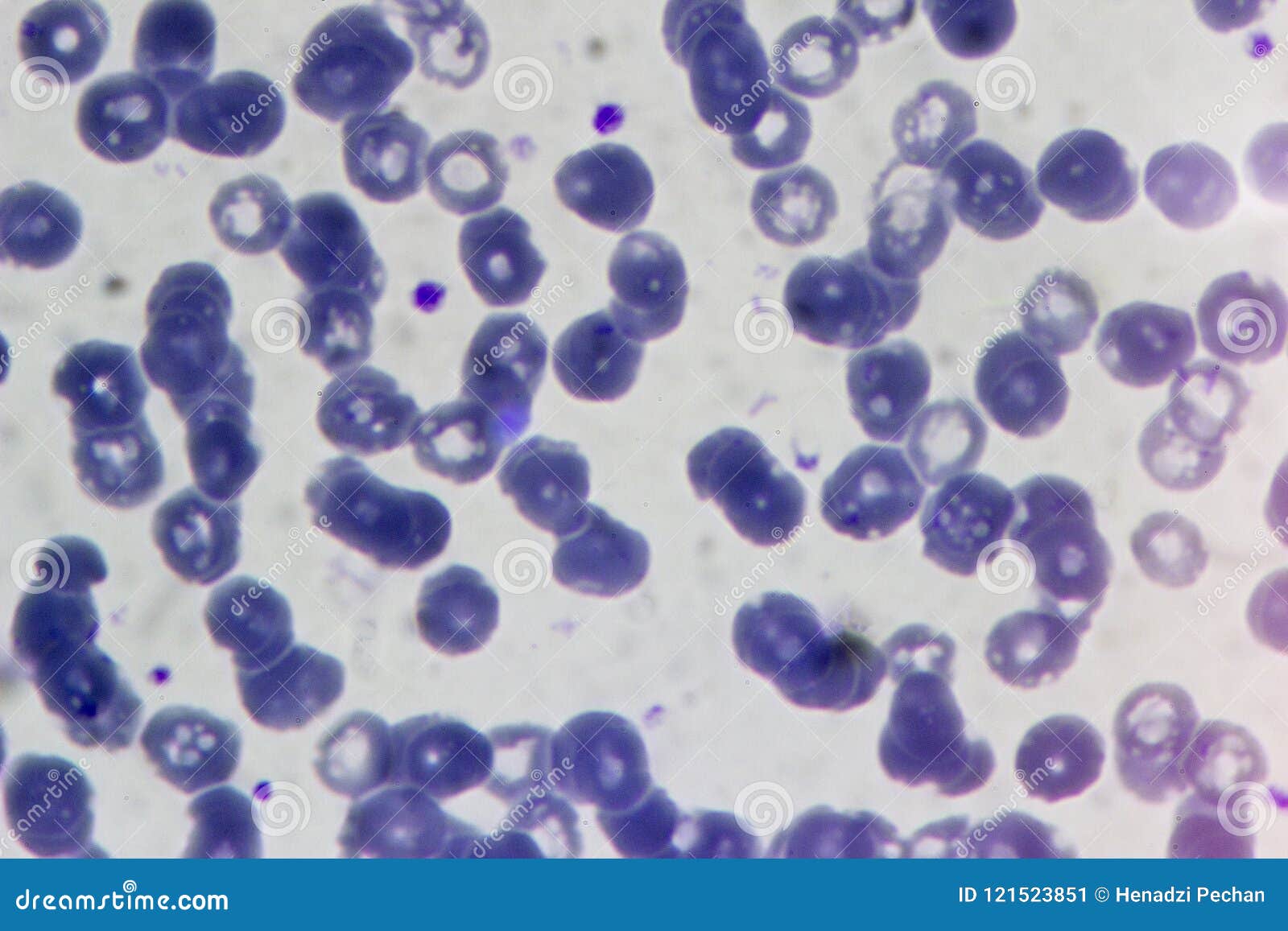 Blood Analysis Under a Microscope, Close-up Stock Image - Image of ...
