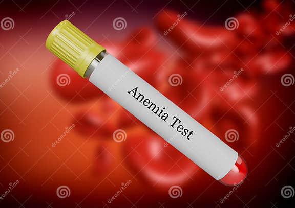 Blood Anemia Test Collected in Test Tube Isolated by Selective Focus ...