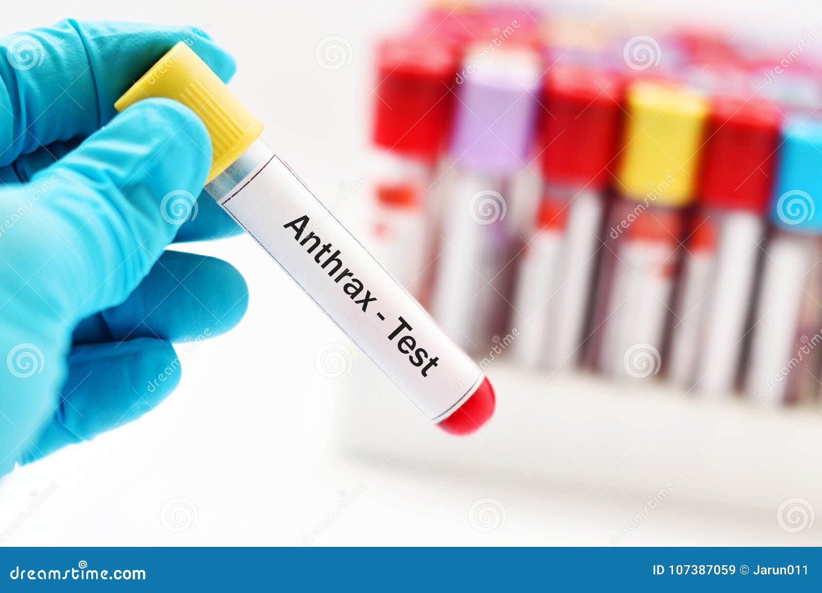 Blood for anthrax test stock image. Image of hazard - 107387059