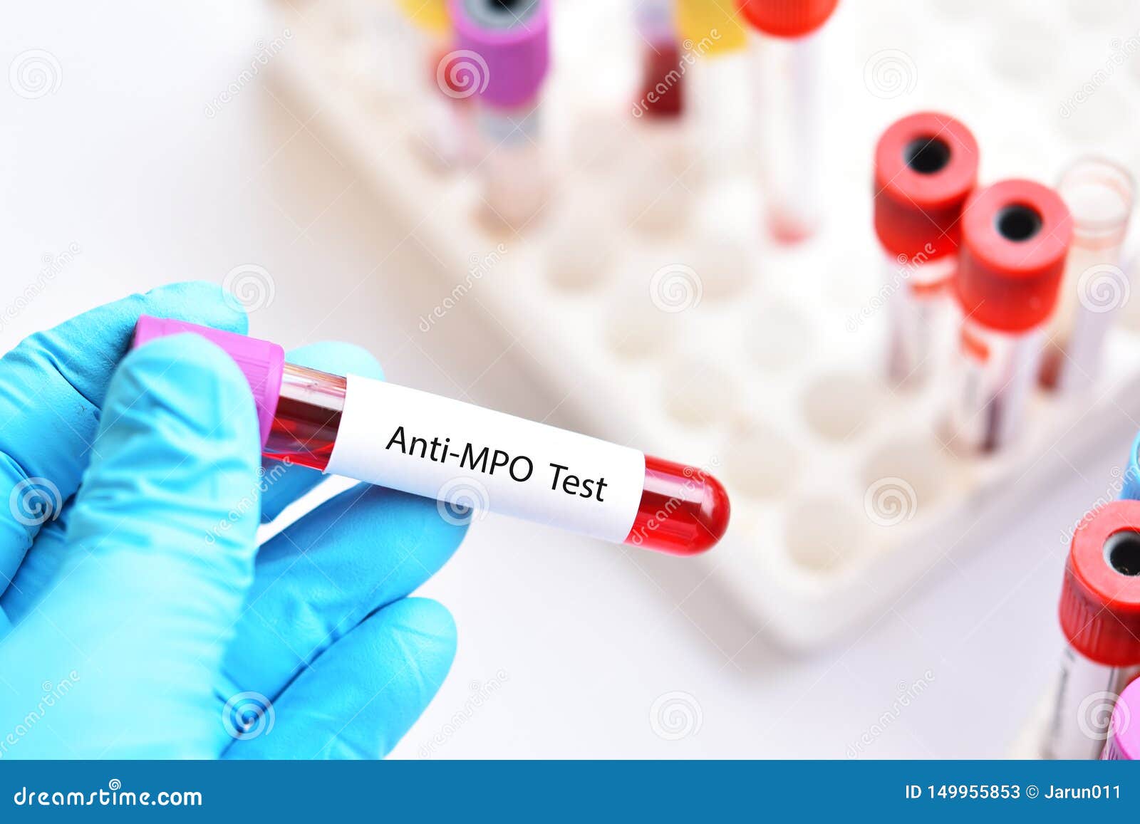 Blood for anti-MPO test stock image. Image of myeloperoxidase - 149955853