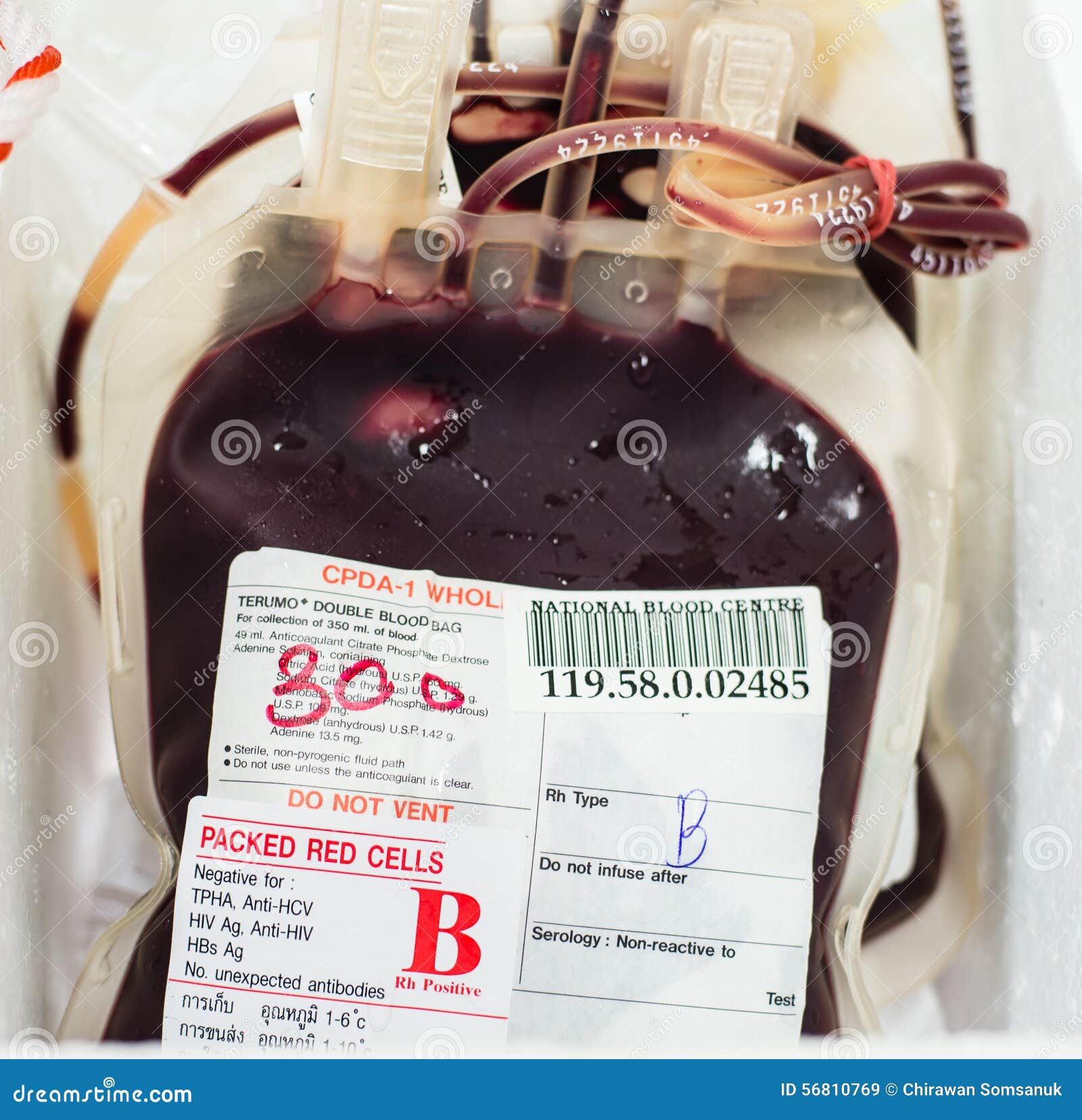 Blood bag stock image. Image of procedure, bank, transfusion - 56810769