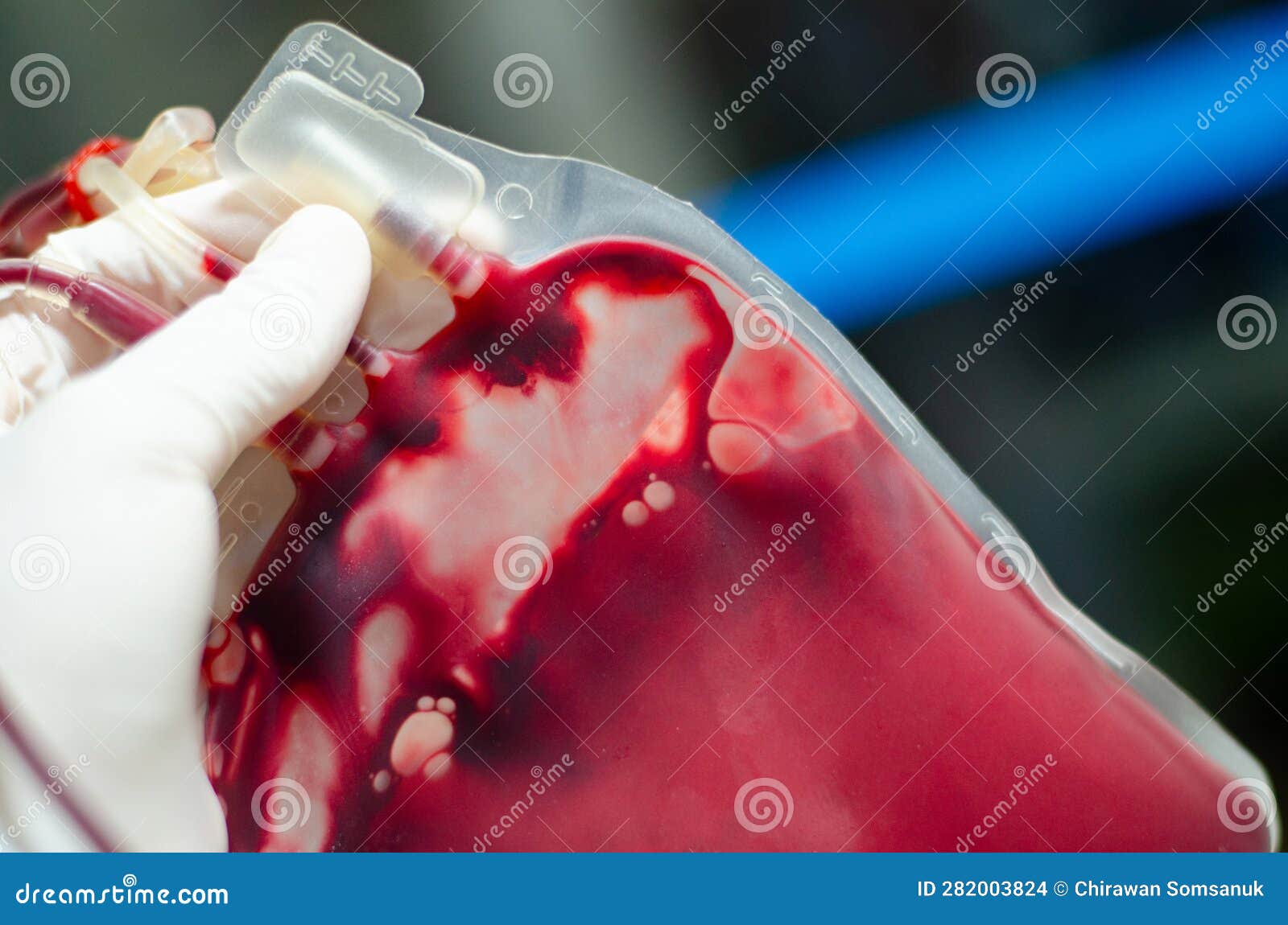 Blood Bag in Blood Bank Lab Stock Photo - Image of hospital, leukemia ...