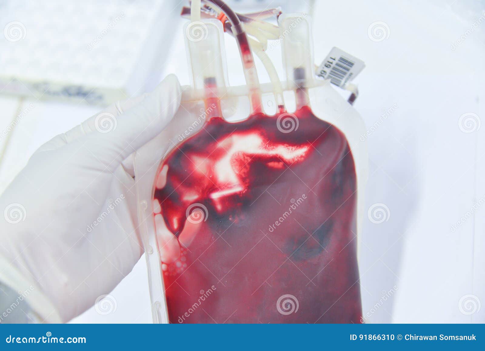 Blood in the blood bag stock photo. Image of medicine - 91866310