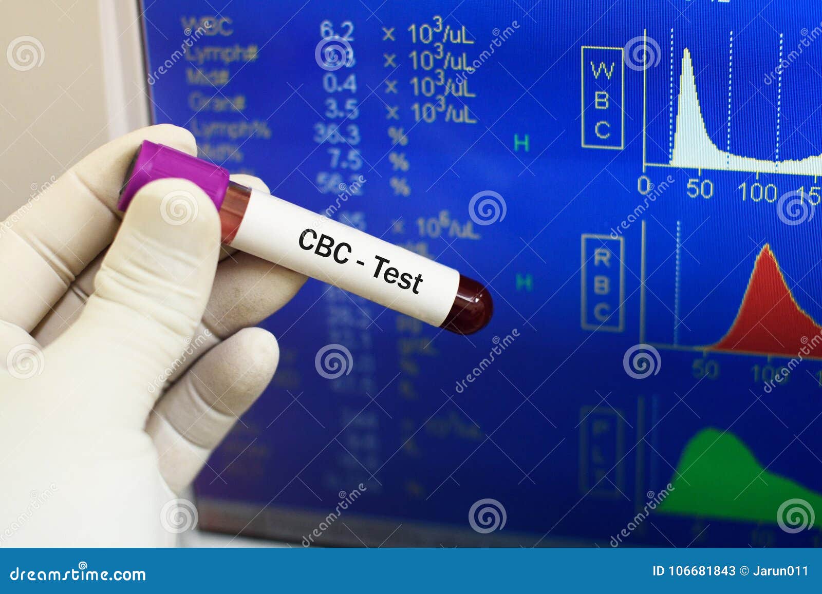 Blood for CBC test stock image. Image of exam, medical - 106681843