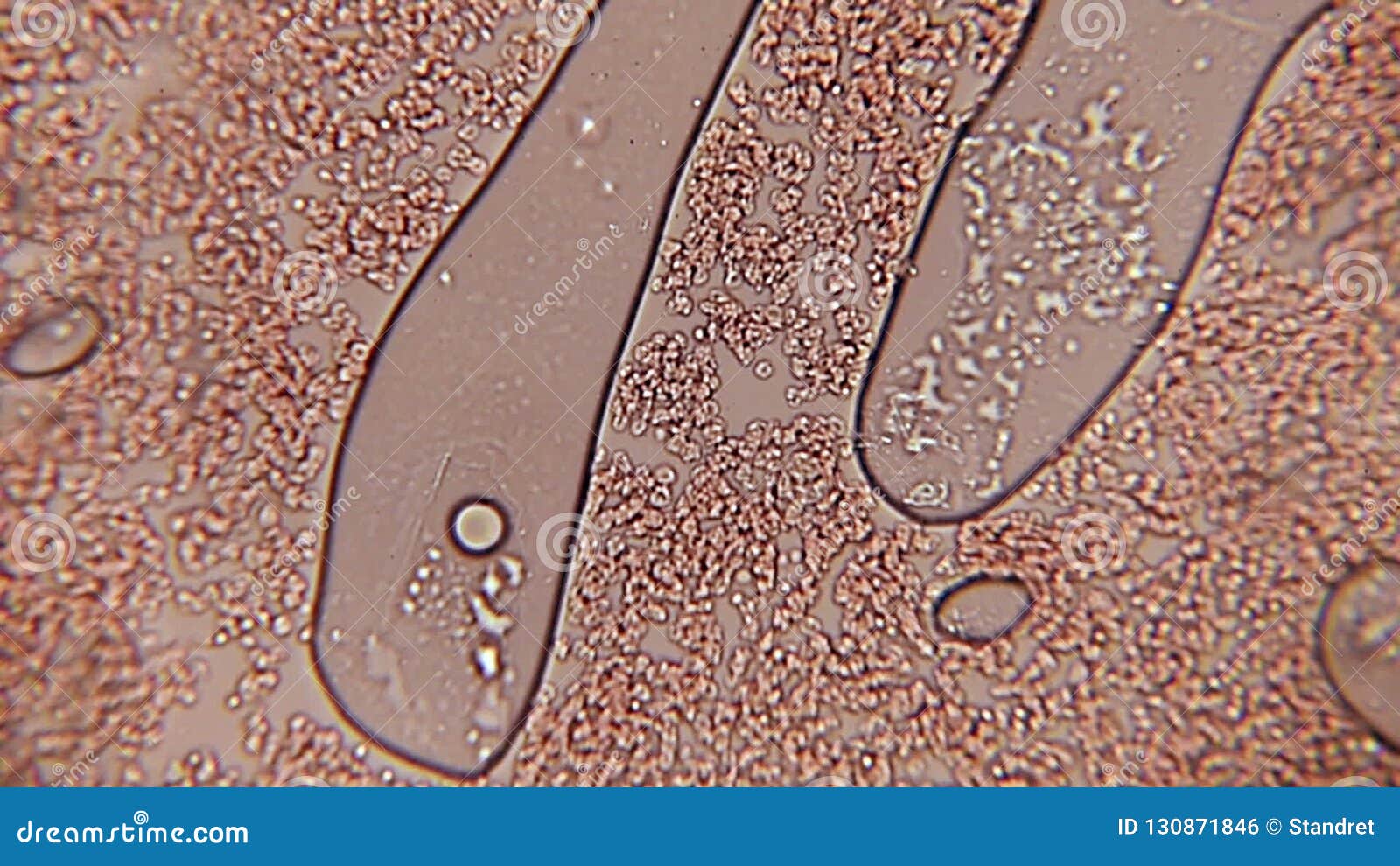 Blood Cell Channel 100x. Blood Platelets Seen Forming a Small Pathway ...