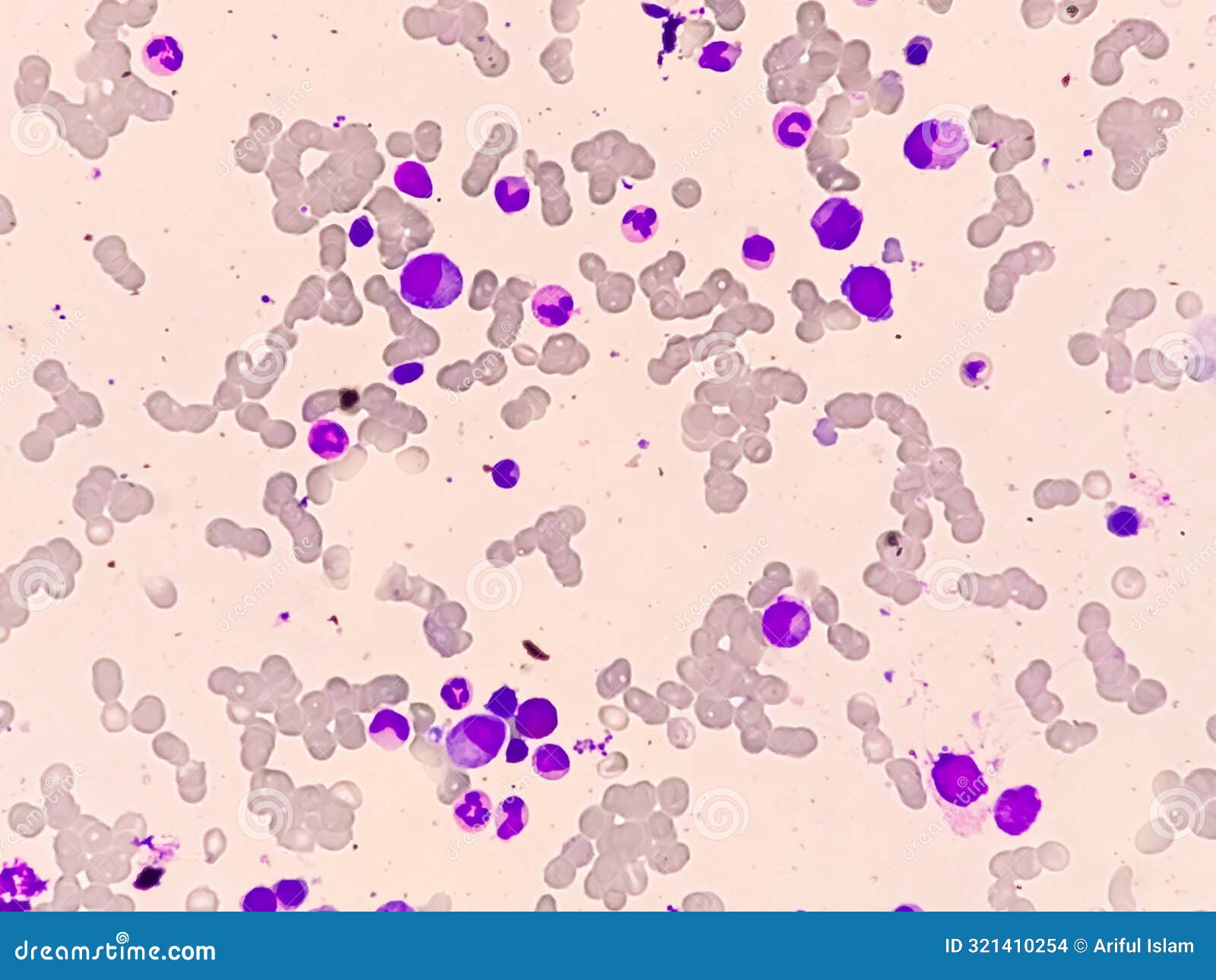 Blood cells in microscope stock photo. Image of excess - 321410254