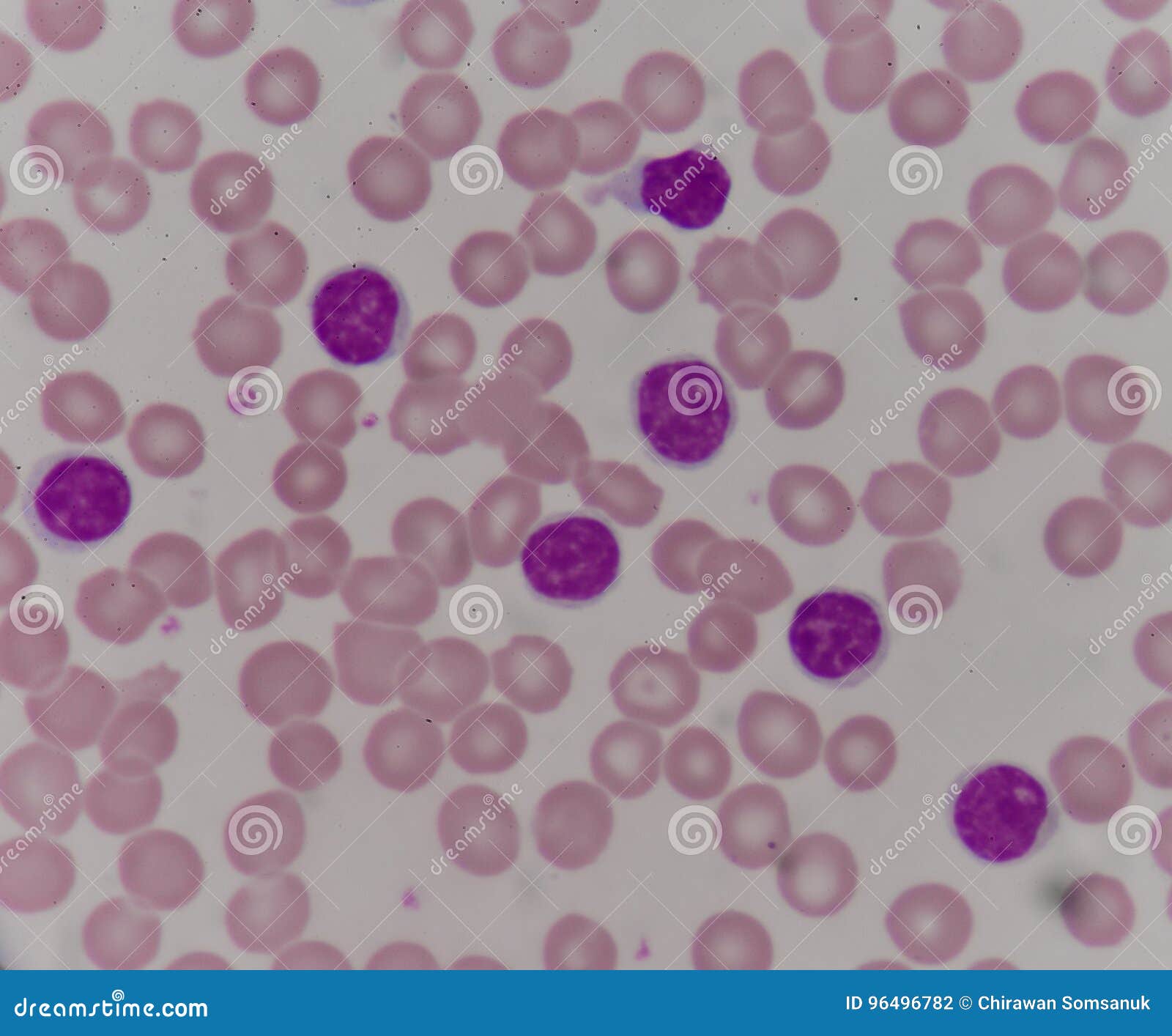 Blood Cells with Microscope. Stock Photo - Image of smell, green: 96496782