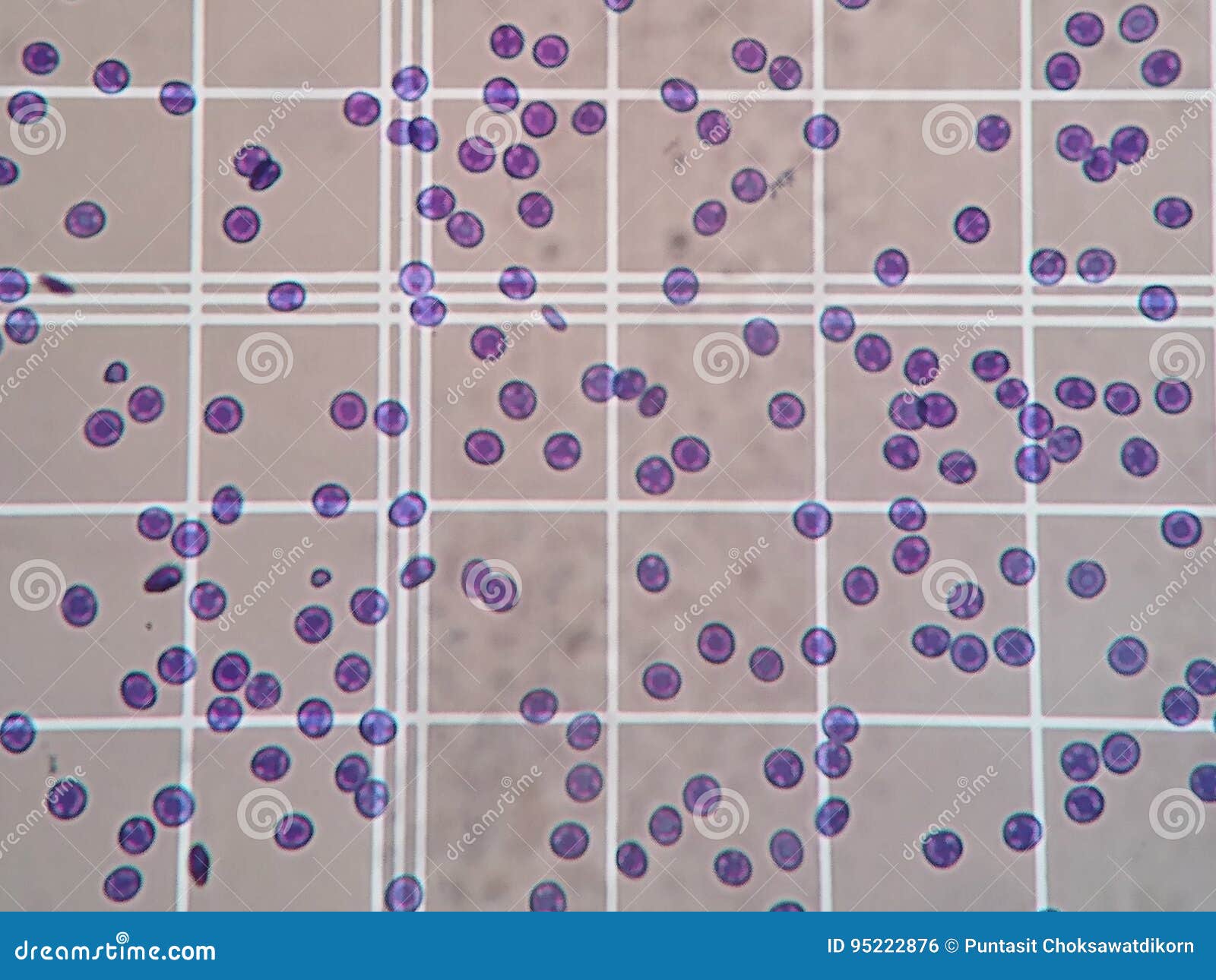 Blood cells stock photo. Image of health, anatomy, cancer - 95222876