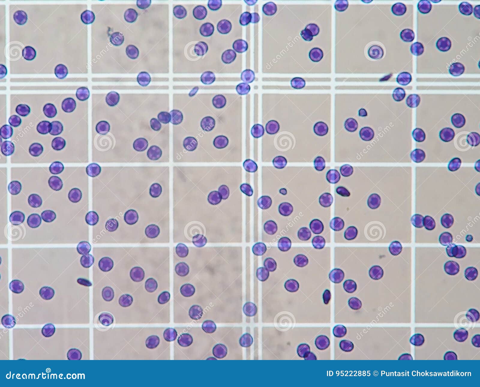 Blood cells stock image. Image of micro, human, magnification - 95222885