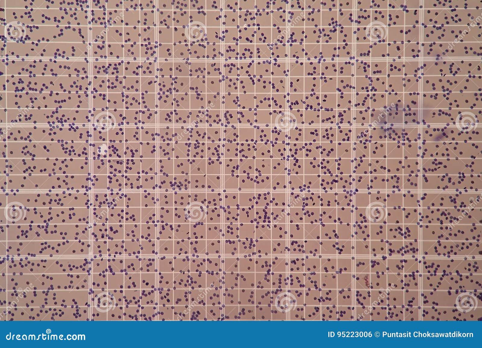 Blood Cells on the Scale Counting Stock Photo - Image of flow, macro ...