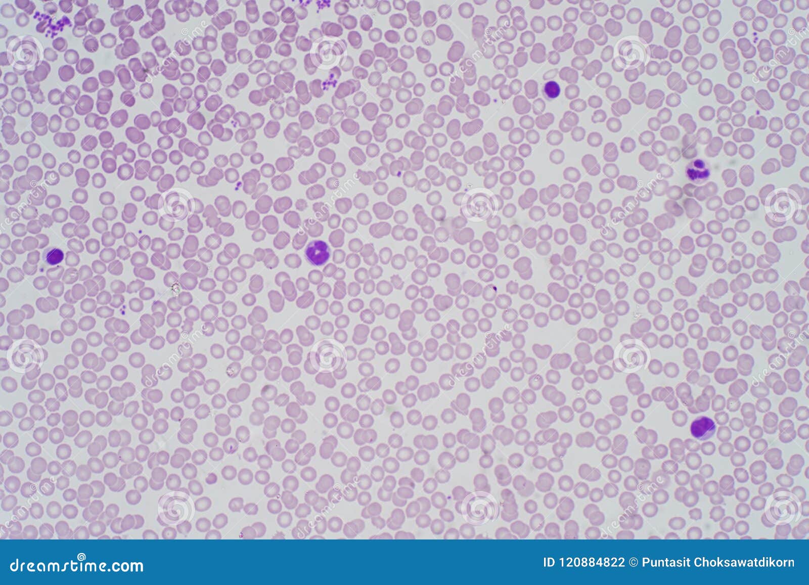 Blood Cells Under Microscope View for Education Stock Photo - Image of ...