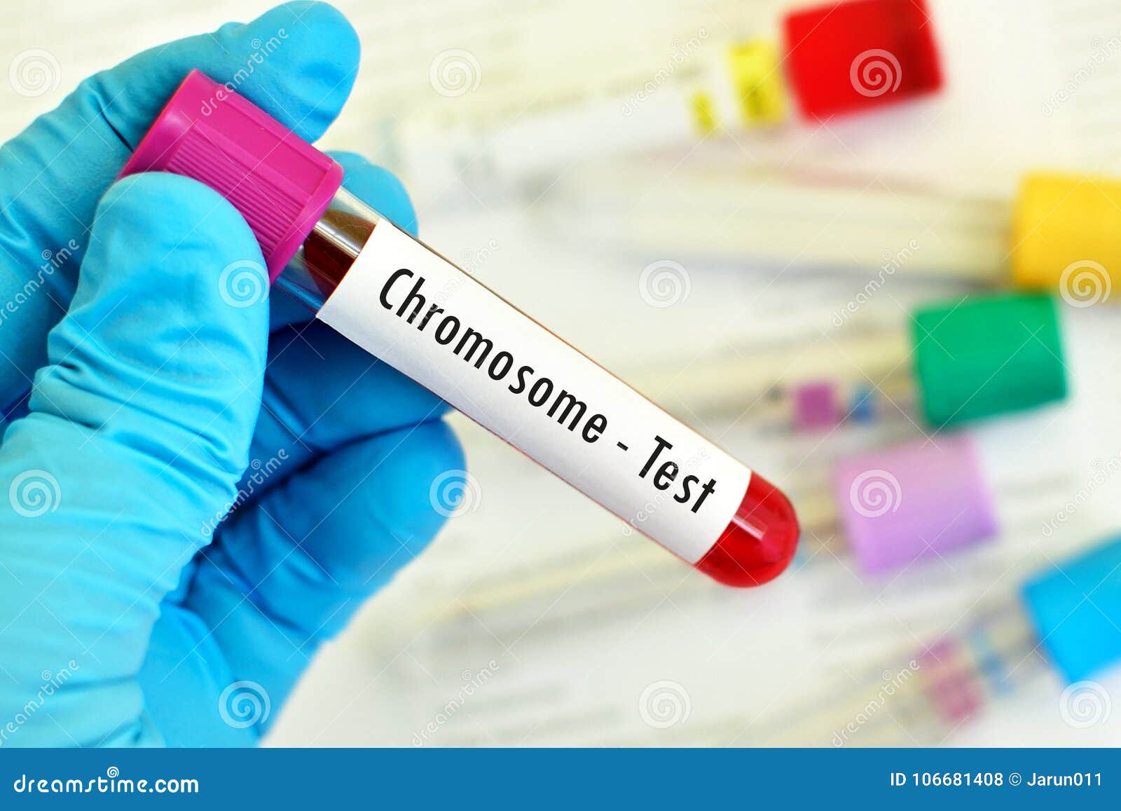 Blood for chromosome test stock photo. Image of research - 106681408