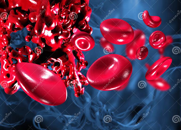 Blood clot stock illustration. Illustration of cell, rbcs - 19983212