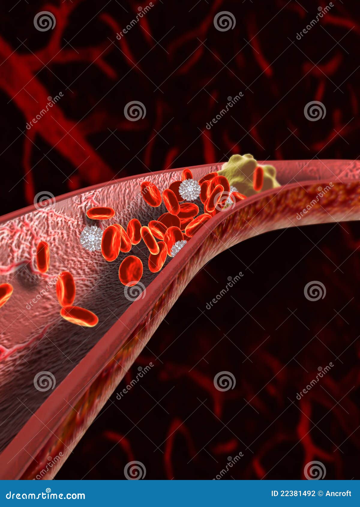 Blood Clot stock illustration. Illustration of close - 22381492
