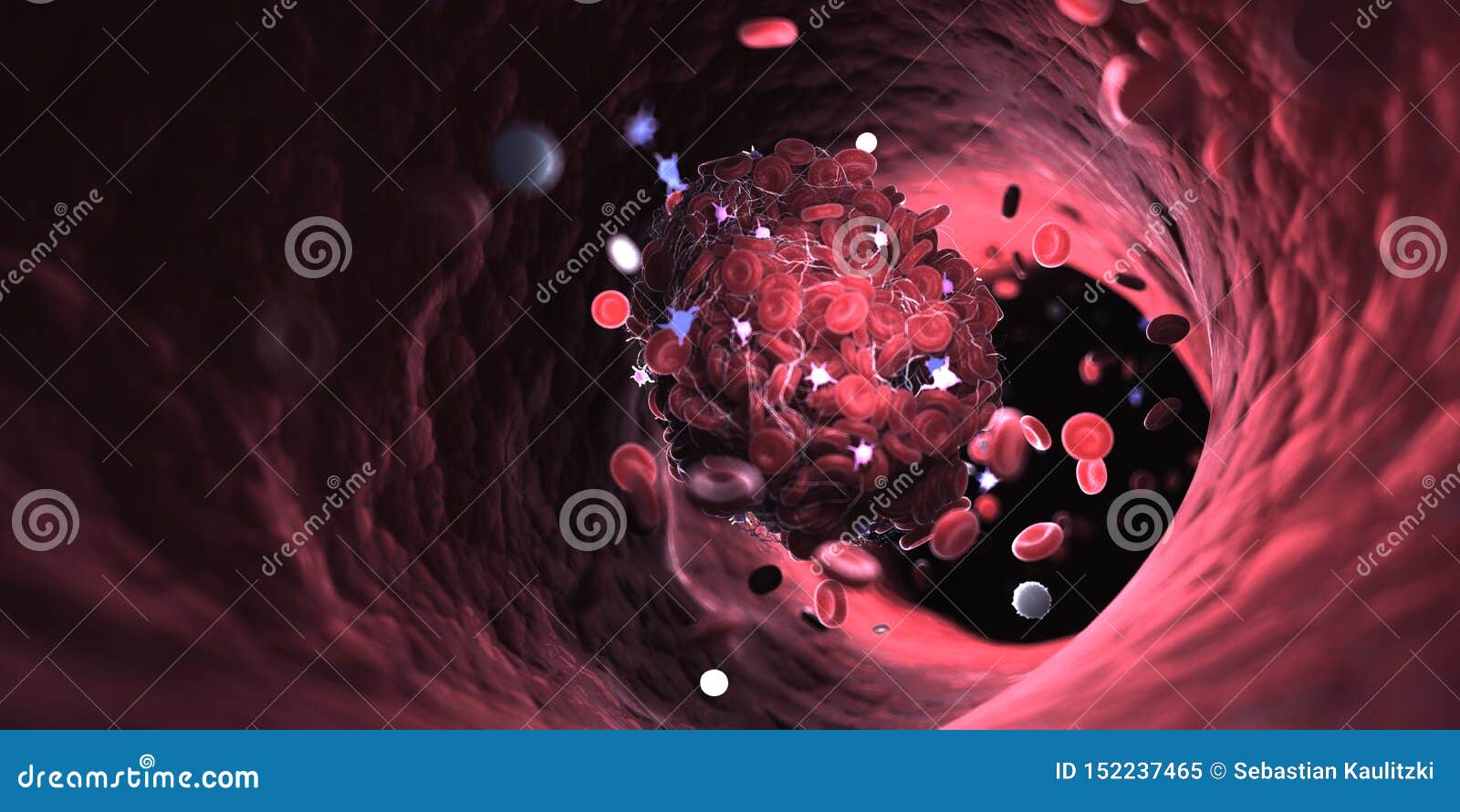 A Blood Clot Royalty-Free Cartoon | CartoonDealer.com #152237465