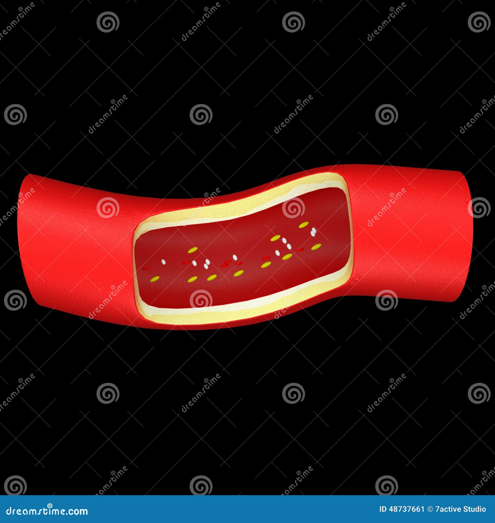 Blood coagulation stock image. Image of condition, cardiovascular ...