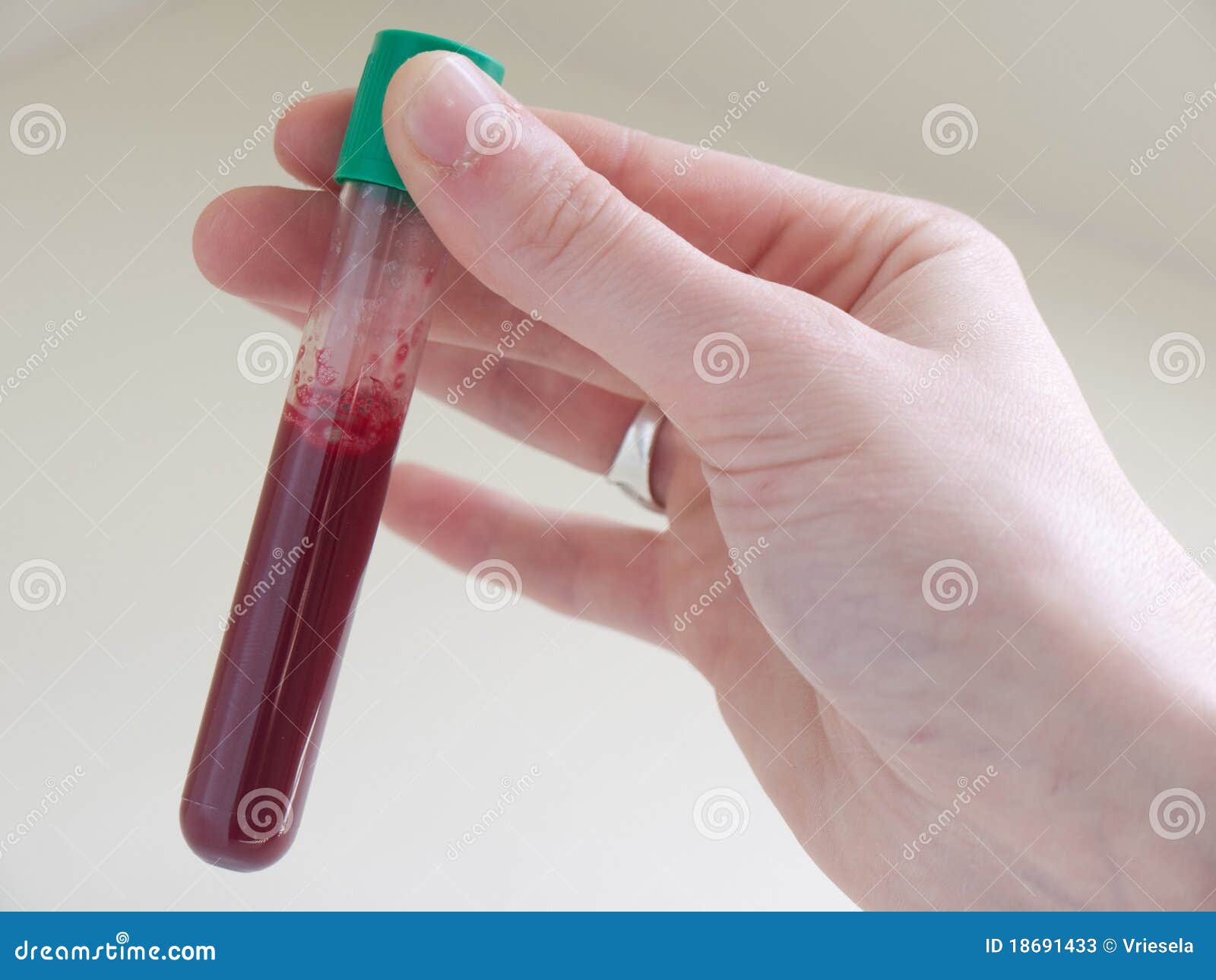 Blood collecting tube stock image. Image of coagulation - 18691433
