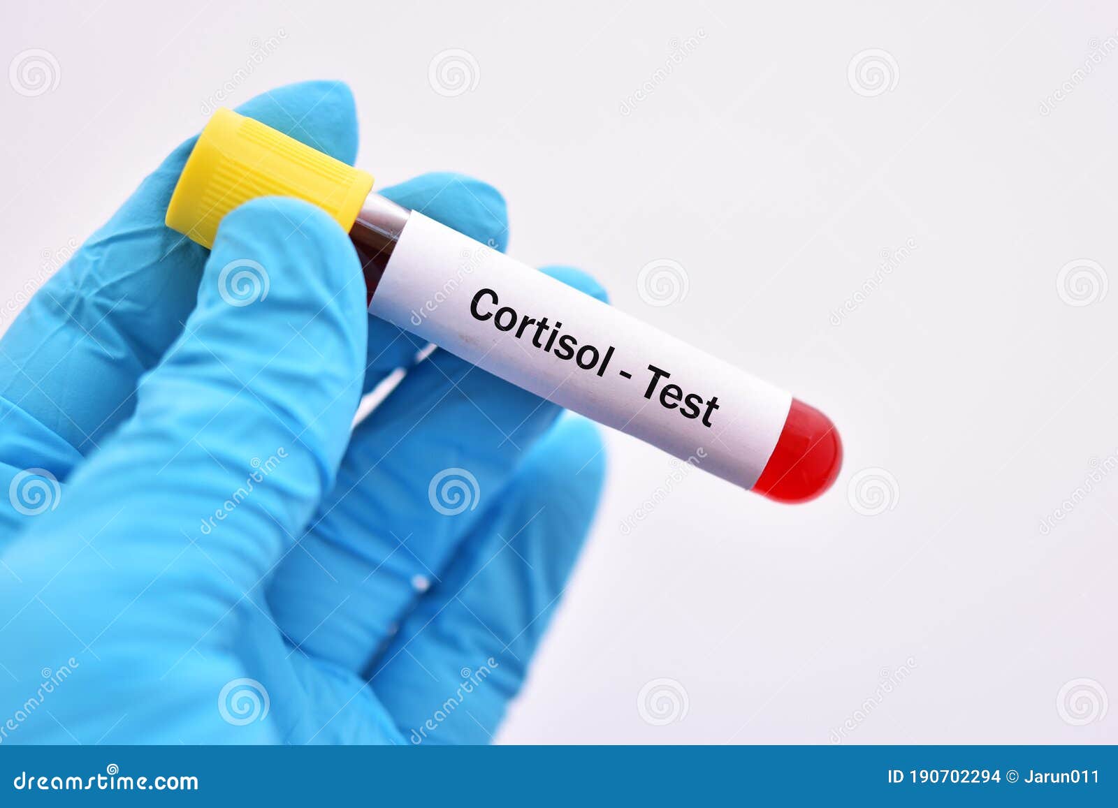 Blood for Cortisol Hormone Test Stock Photo - Image of endorphins ...
