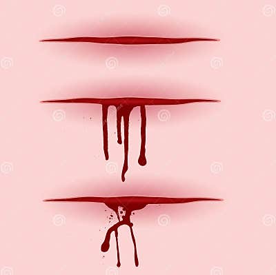 Blood cut stock vector. Illustration of pain, sickness - 8170695