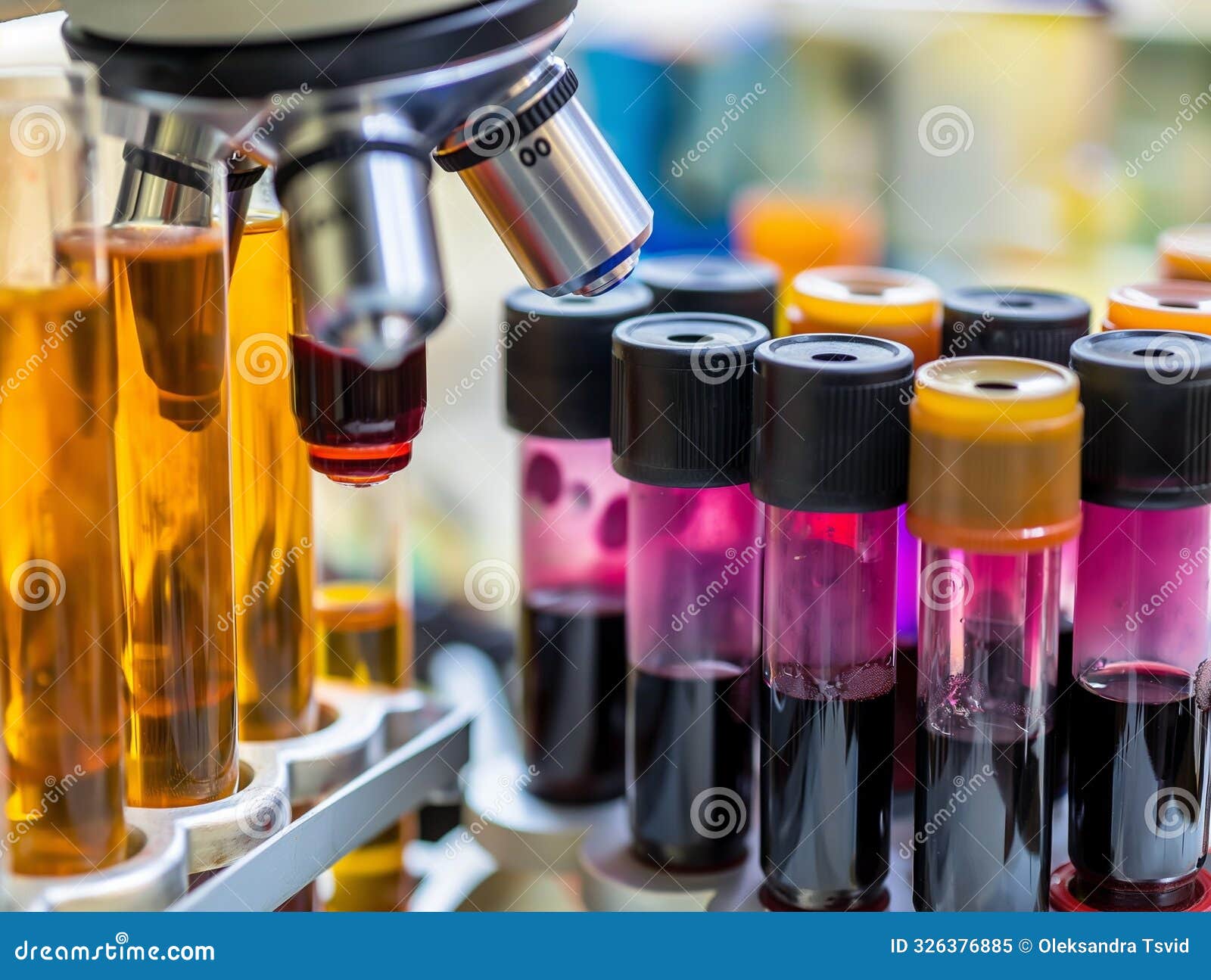 Blood Drawing Equipment in Laboratory for Analysis Stock Image - Image ...