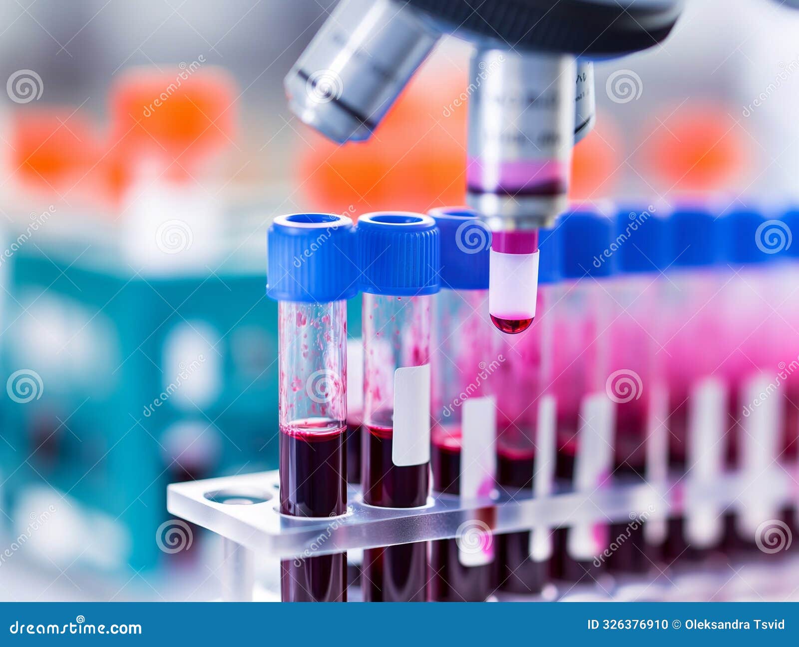 Blood Drawing Equipment in Laboratory for Analysis Stock Photo - Image ...