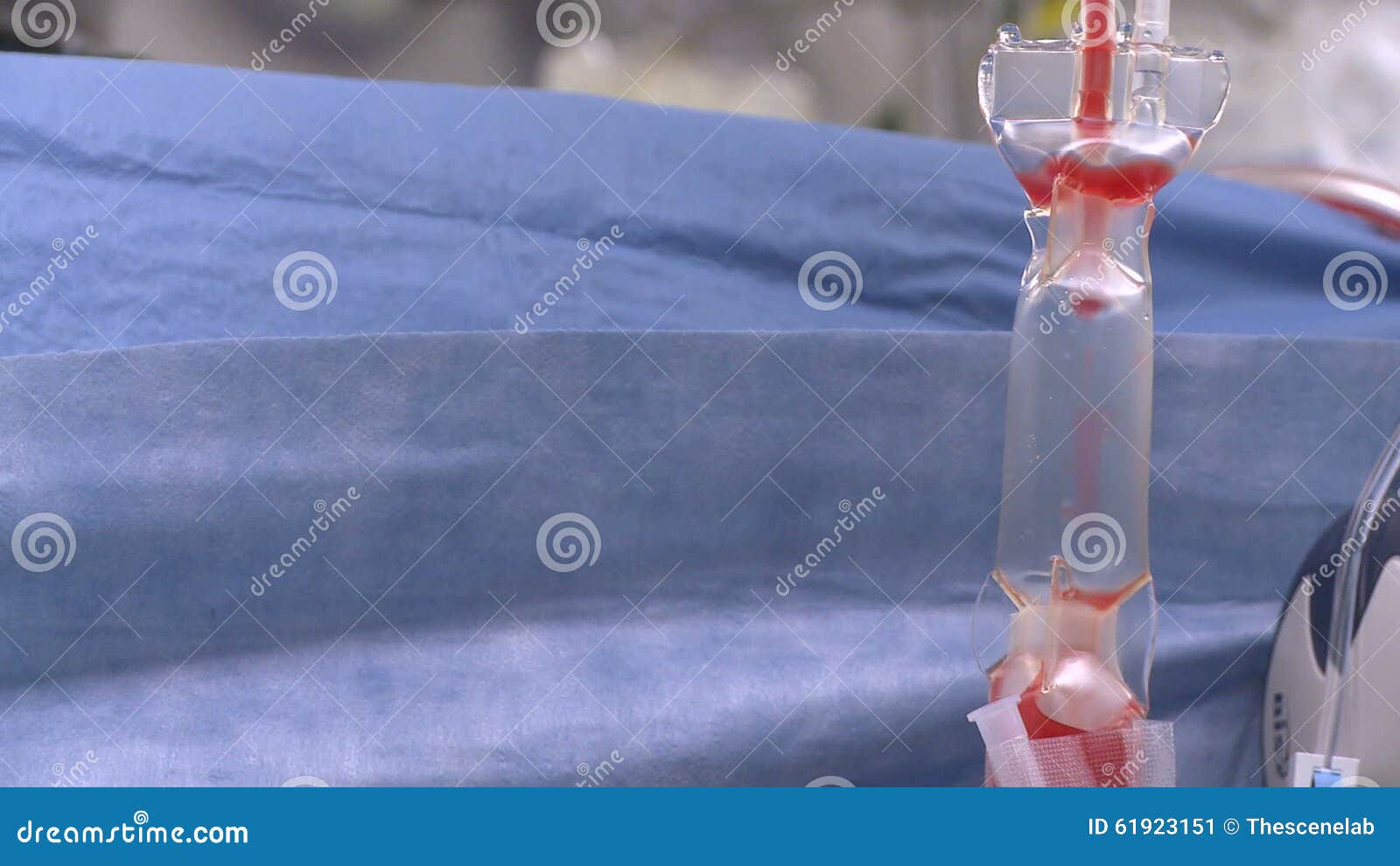 Blood Drip during Surgery (1 of 2) Stock Video - Video of organ ...
