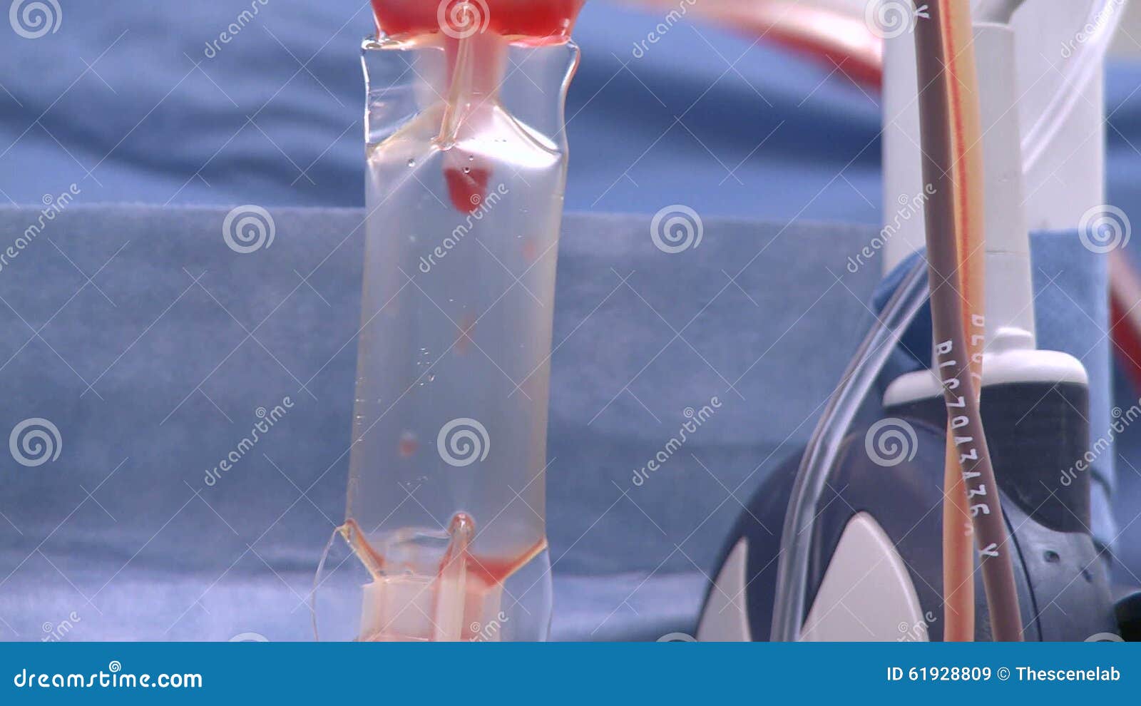 Blood Drip during Surgery (2 of 2) Stock Video - Video of laparascopic ...