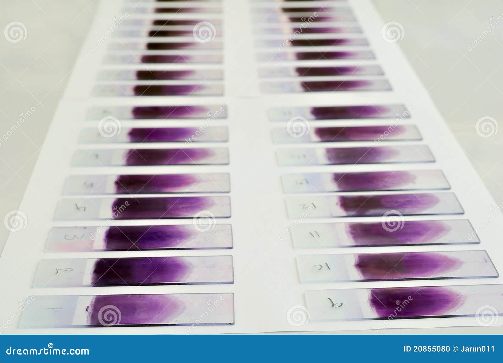 Blood film stock photo. Image of equipment, medicine - 20855080