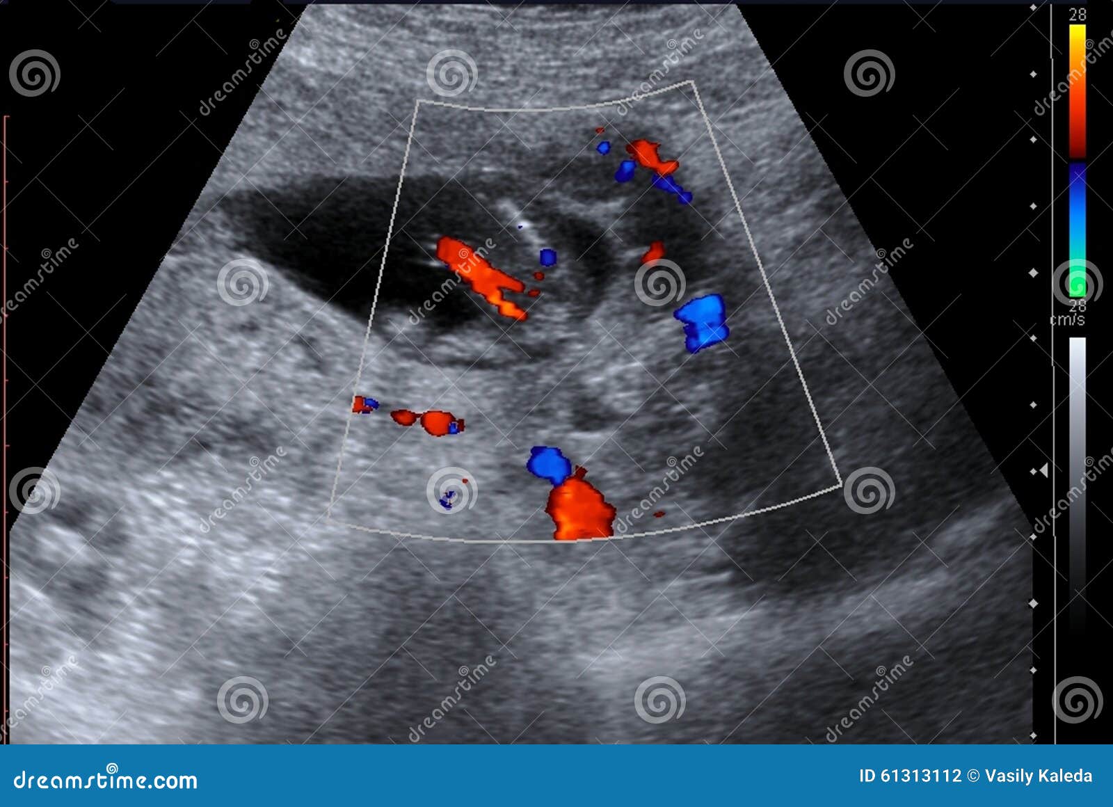 Blood flow in placenta stock photo. Image of dimension - 61313112