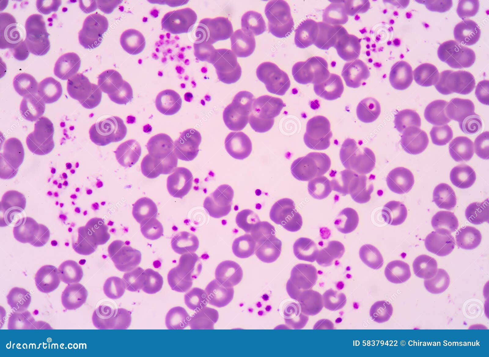 Blood formation. stock photo. Image of macro, micro, biological - 58379422
