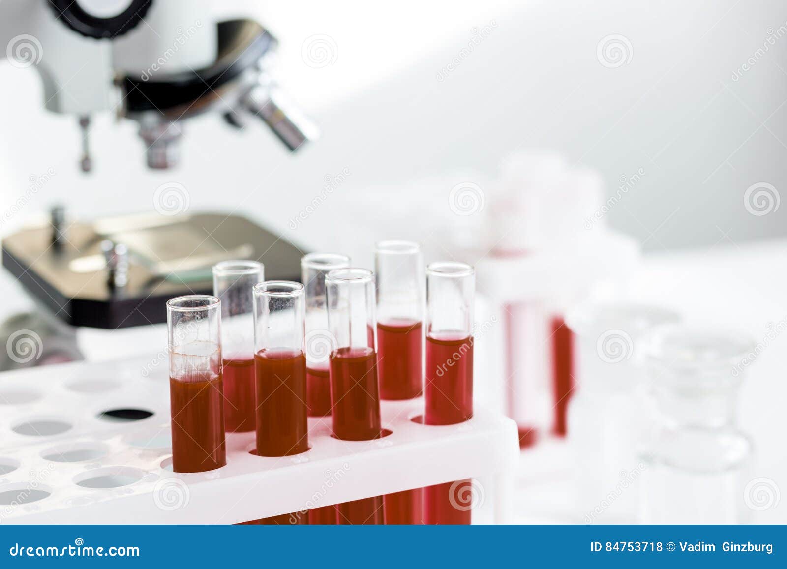Blood in Glass Tubes on Background of Microscope Stock Photo - Image of ...