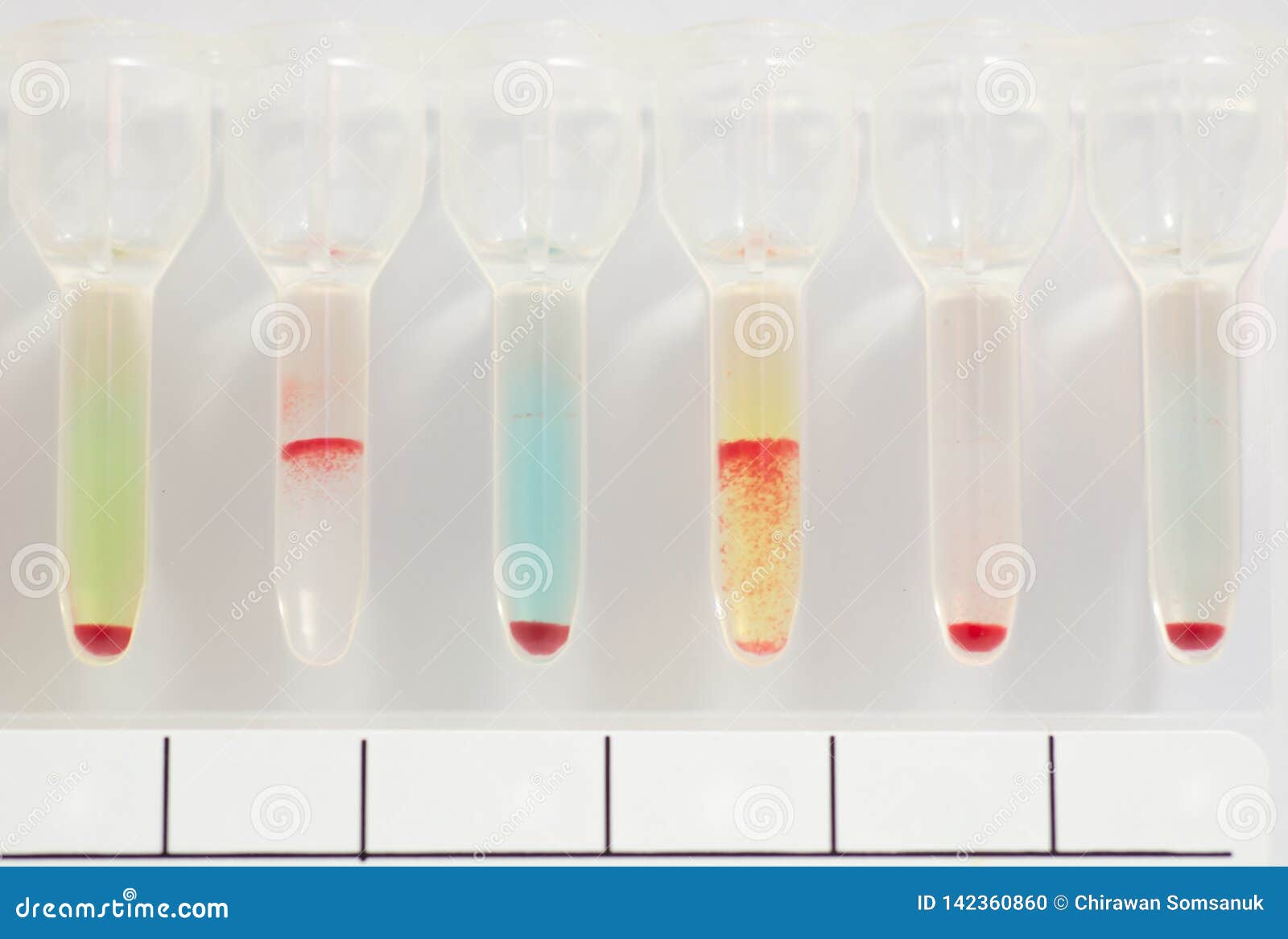 Blood Group ABO Typing Gel Test Stock Photo - Image of antigen ...
