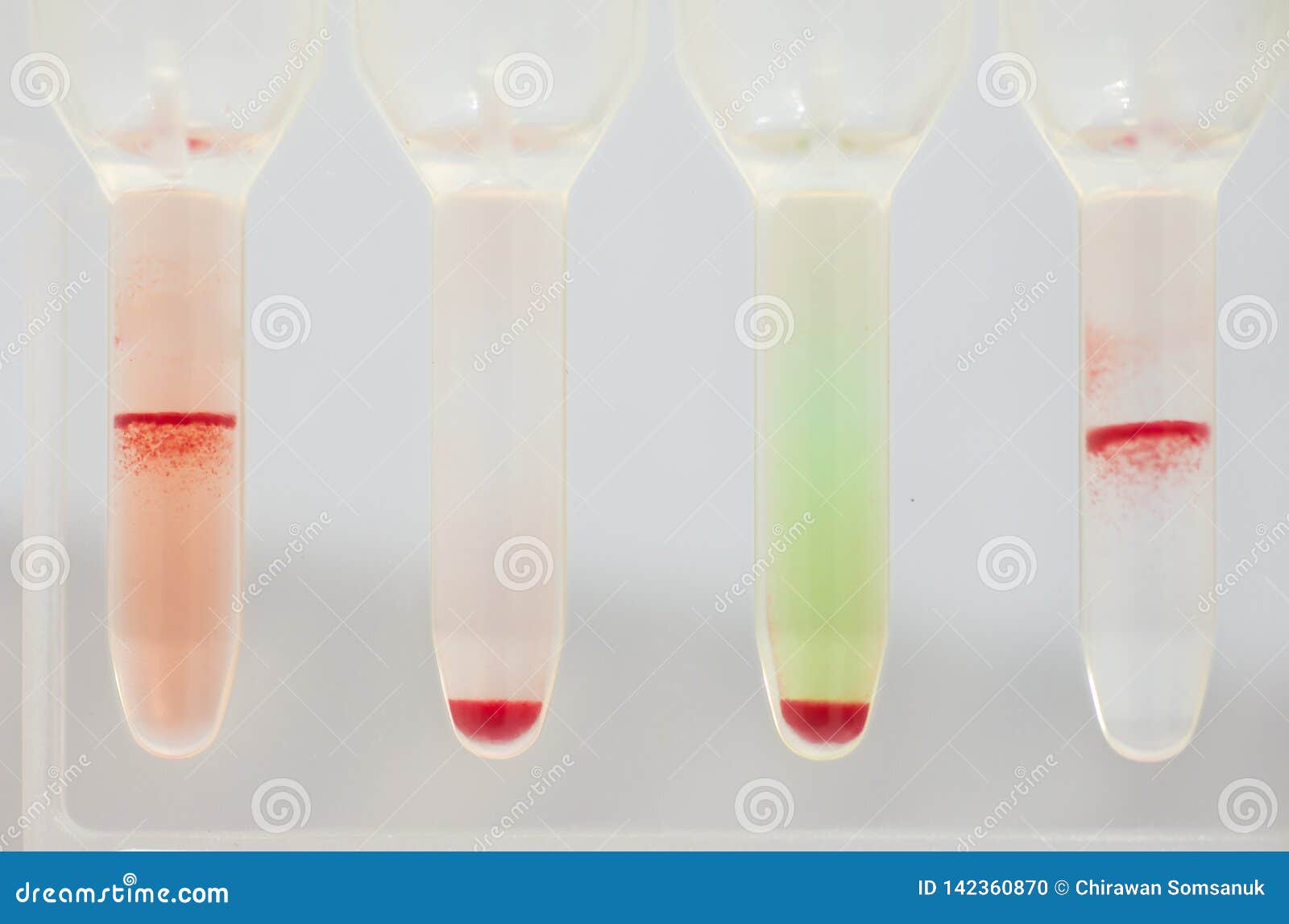 Blood Group ABO Typing Gel Test Stock Photo - Image of diagram ...
