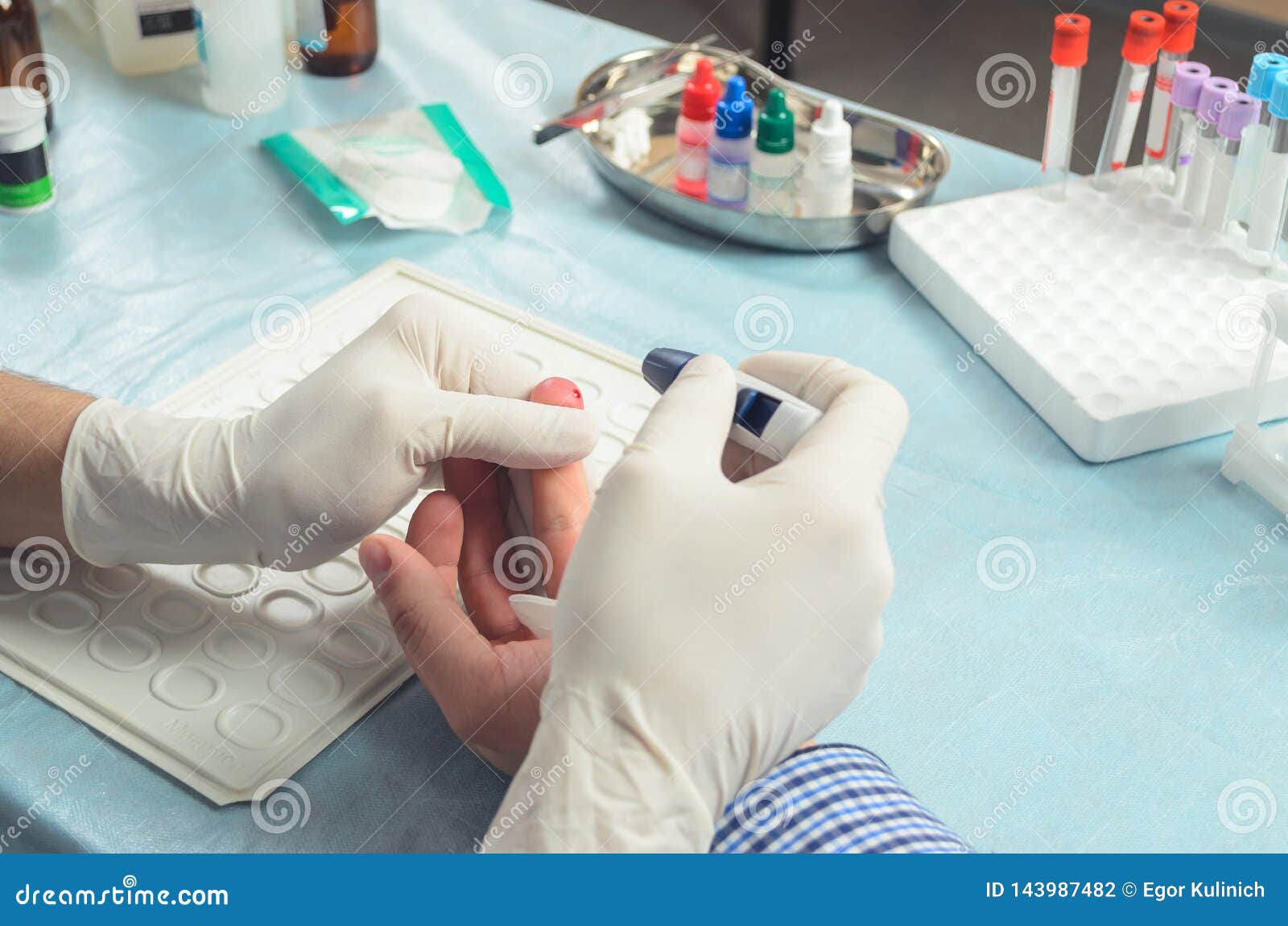 Blood Group and Rh Factor Testing Stock Photo - Image of colyclons ...