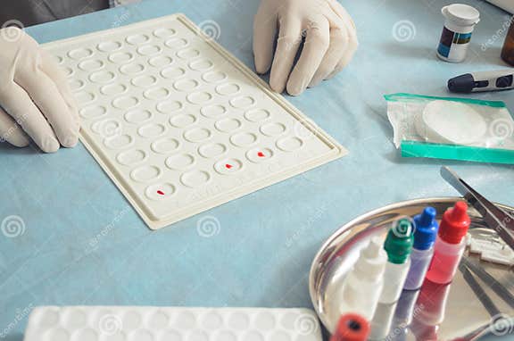 Blood Group and Rh Factor Testing Stock Image - Image of groups ...