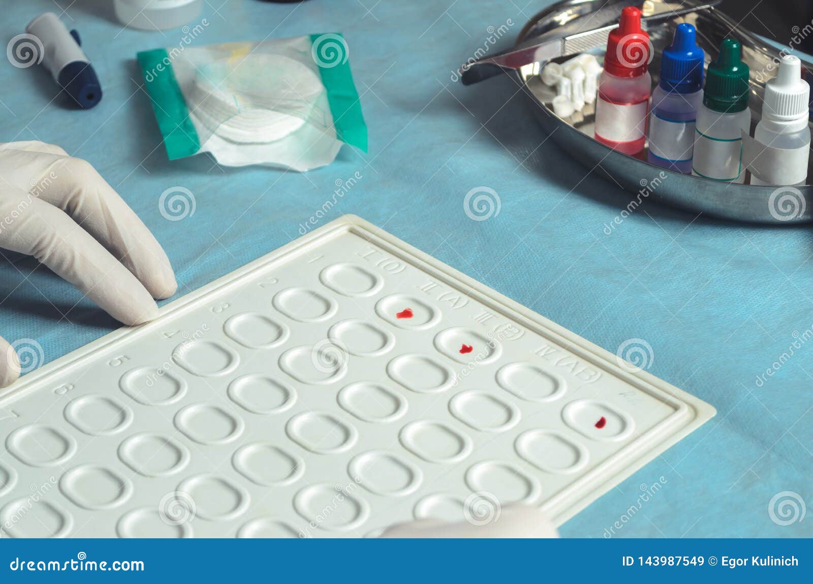 Blood Group and Rh Factor Testing Stock Image - Image of medical ...