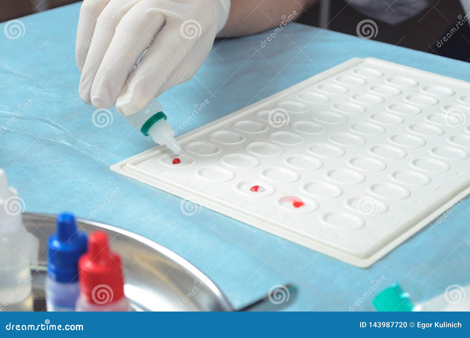 Blood Group and Rh Factor Testing Stock Photo - Image of analyzing ...