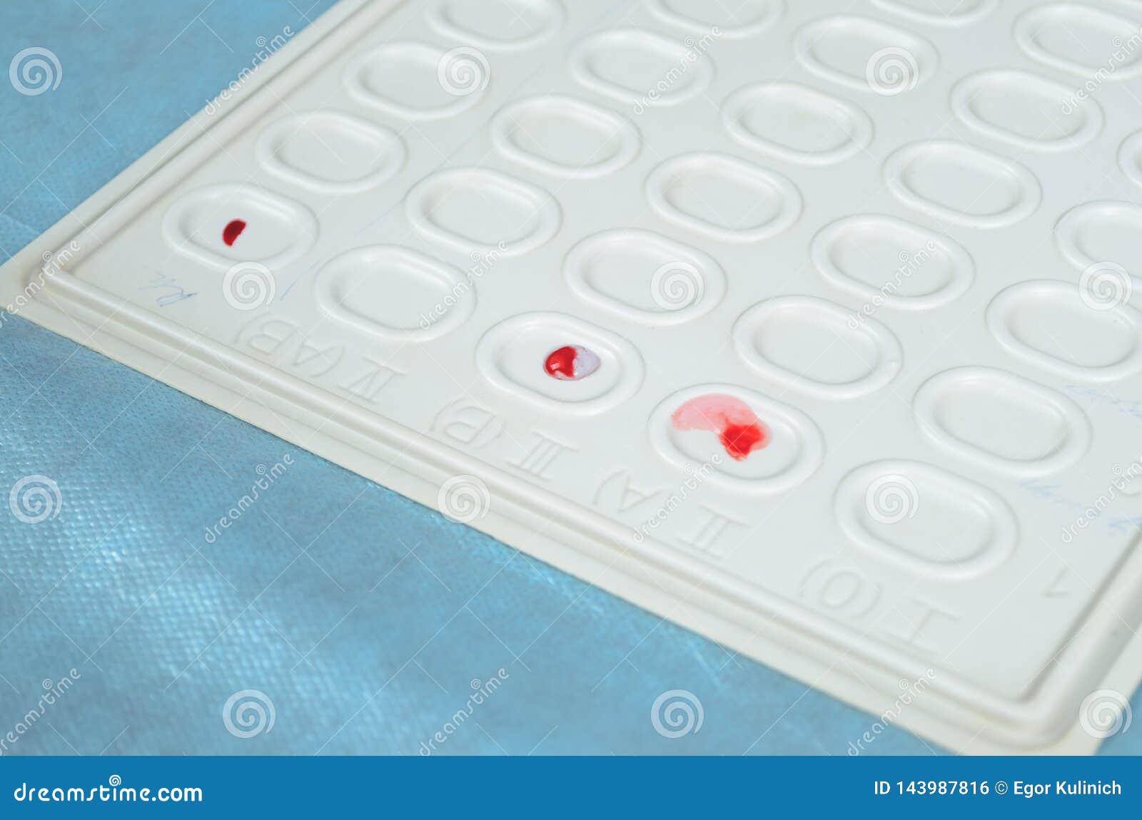 Blood Group and Rh Factor Testing Stock Photo - Image of group, cells ...