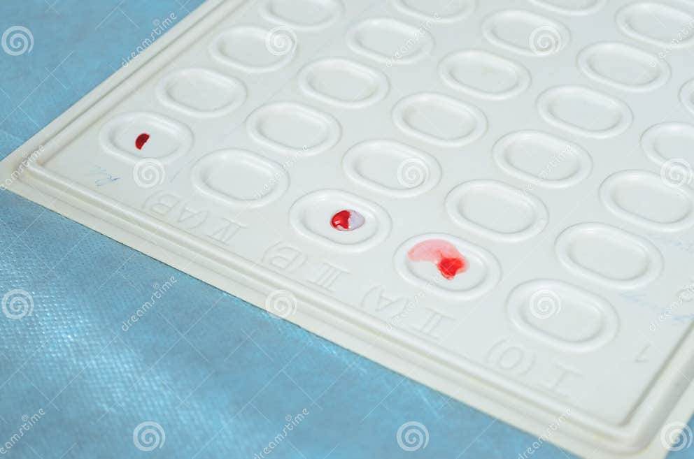 Blood Group and Rh Factor Testing Stock Photo - Image of group, cells ...