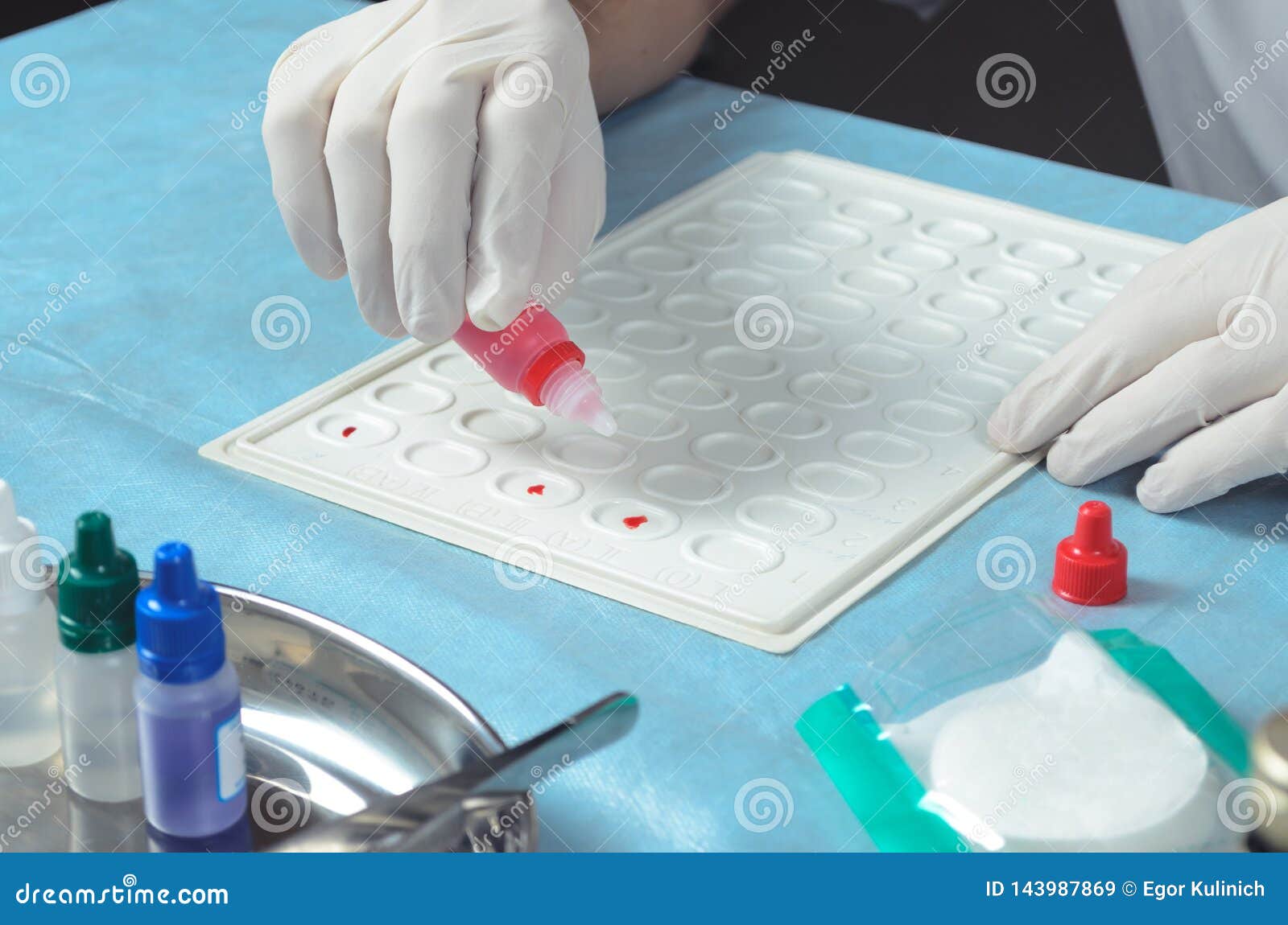 Blood Group and Rh Factor Testing Stock Image - Image of biology, bank ...