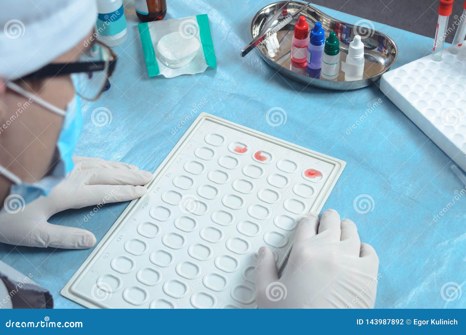 Blood Group and Rh Factor Testing Stock Photo - Image of hematology ...